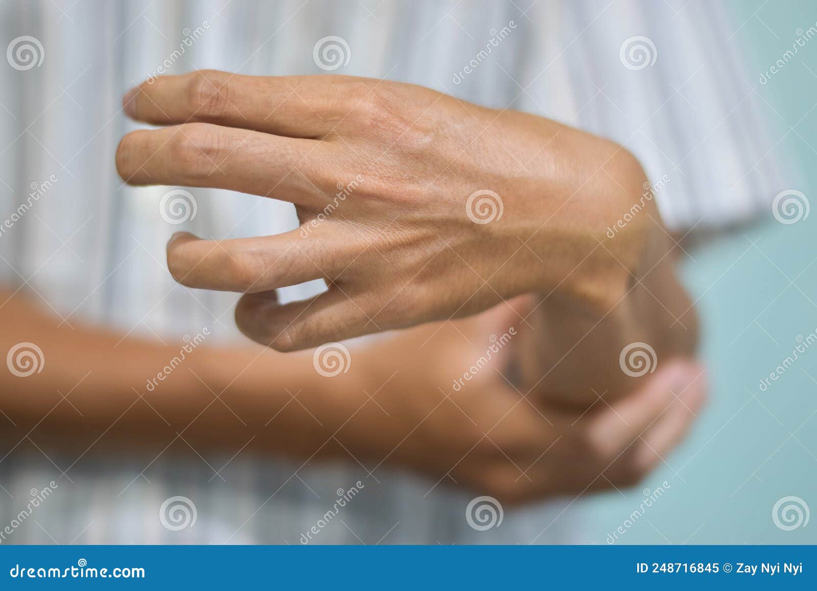 Fingers Rigidity, Hand Muscles Spasm, or Weakness of Digits Stock Image ...
