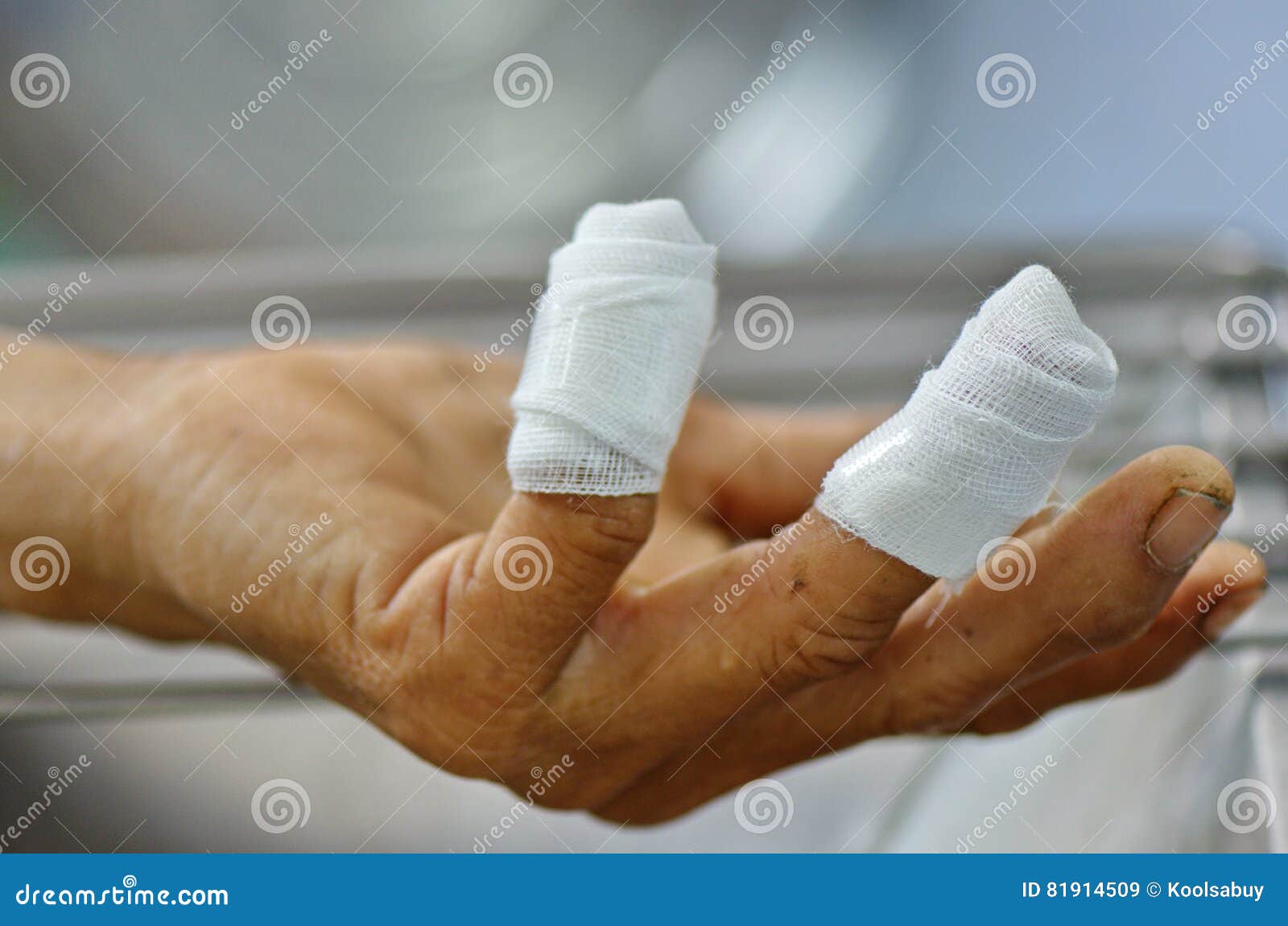 Fingers wound. stock image. Image of finger, white, patient - 81914509
