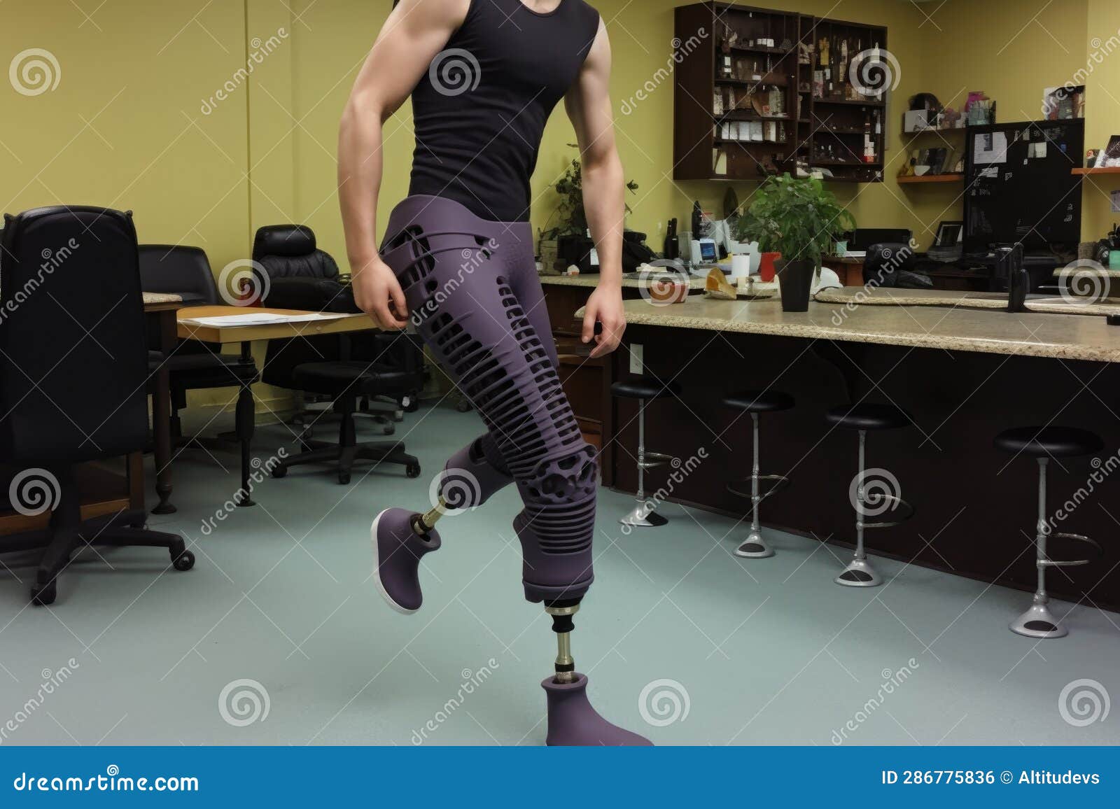 Finished 3d Printed Prosthetic Leg Stock Illustration - Illustration of ...