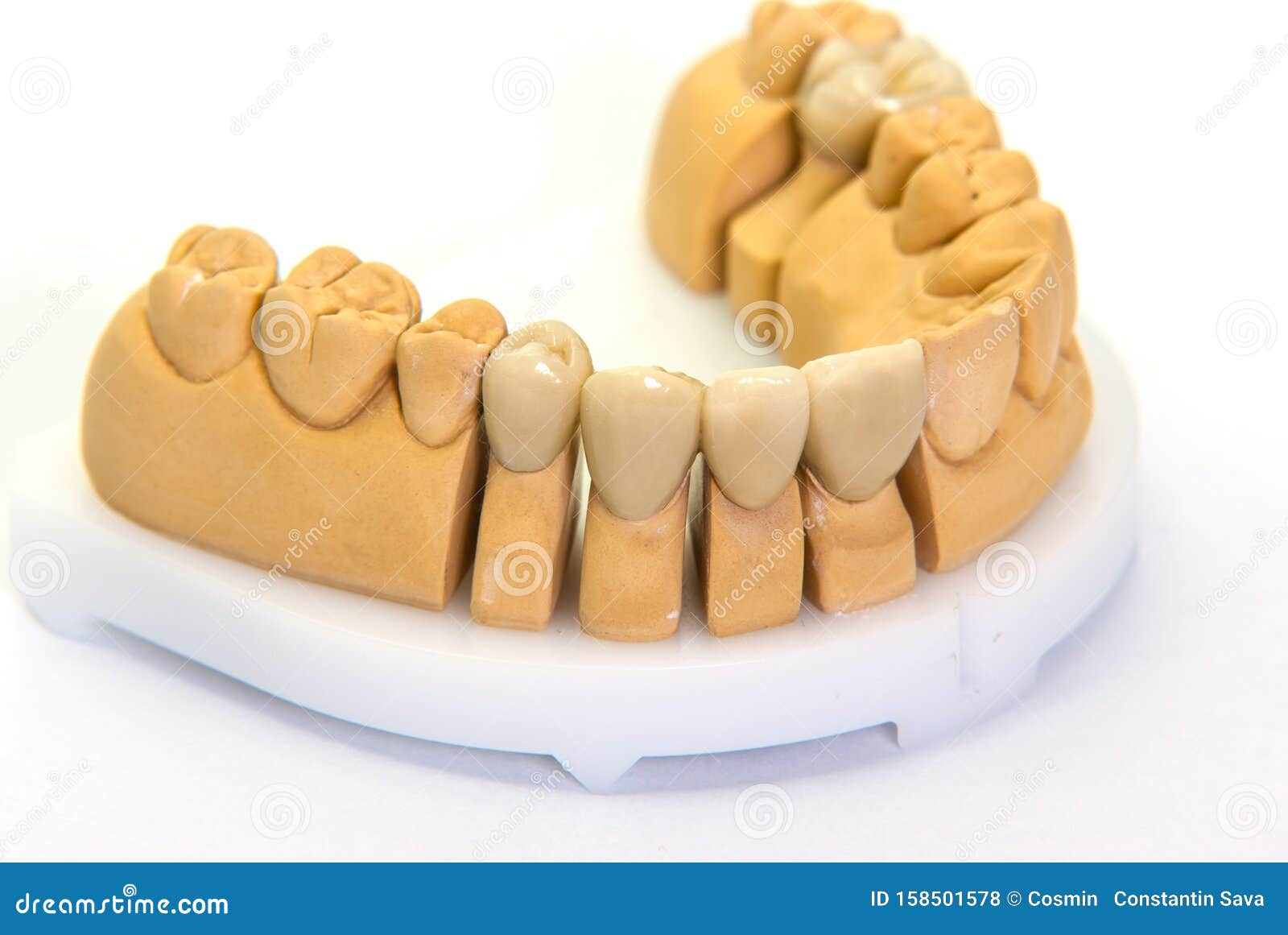 Porcelain Teeth - Color Guide Royalty-Free Stock Photography ...