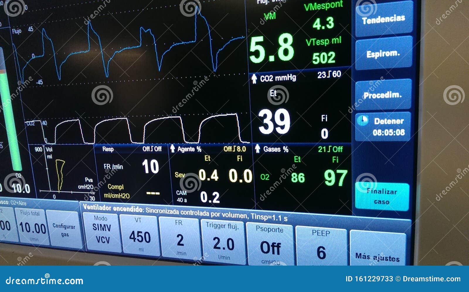 Finishing off anesthesia stock image. Image of settings - 161229733 Finishing off anesthesia stock image. Image of settings - 161229733