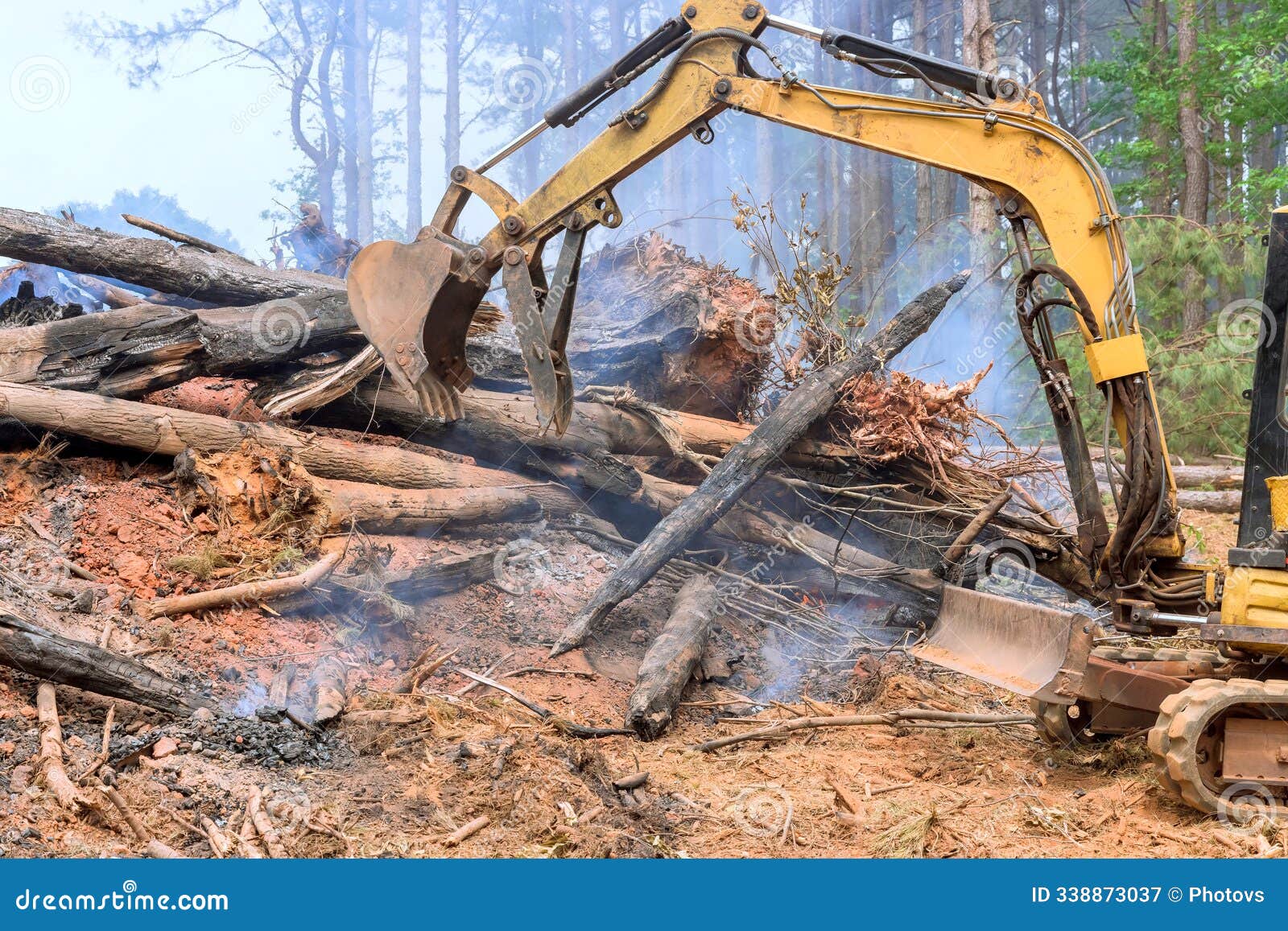 Removing Burned Human Skin Royalty-Free Stock Photography ...