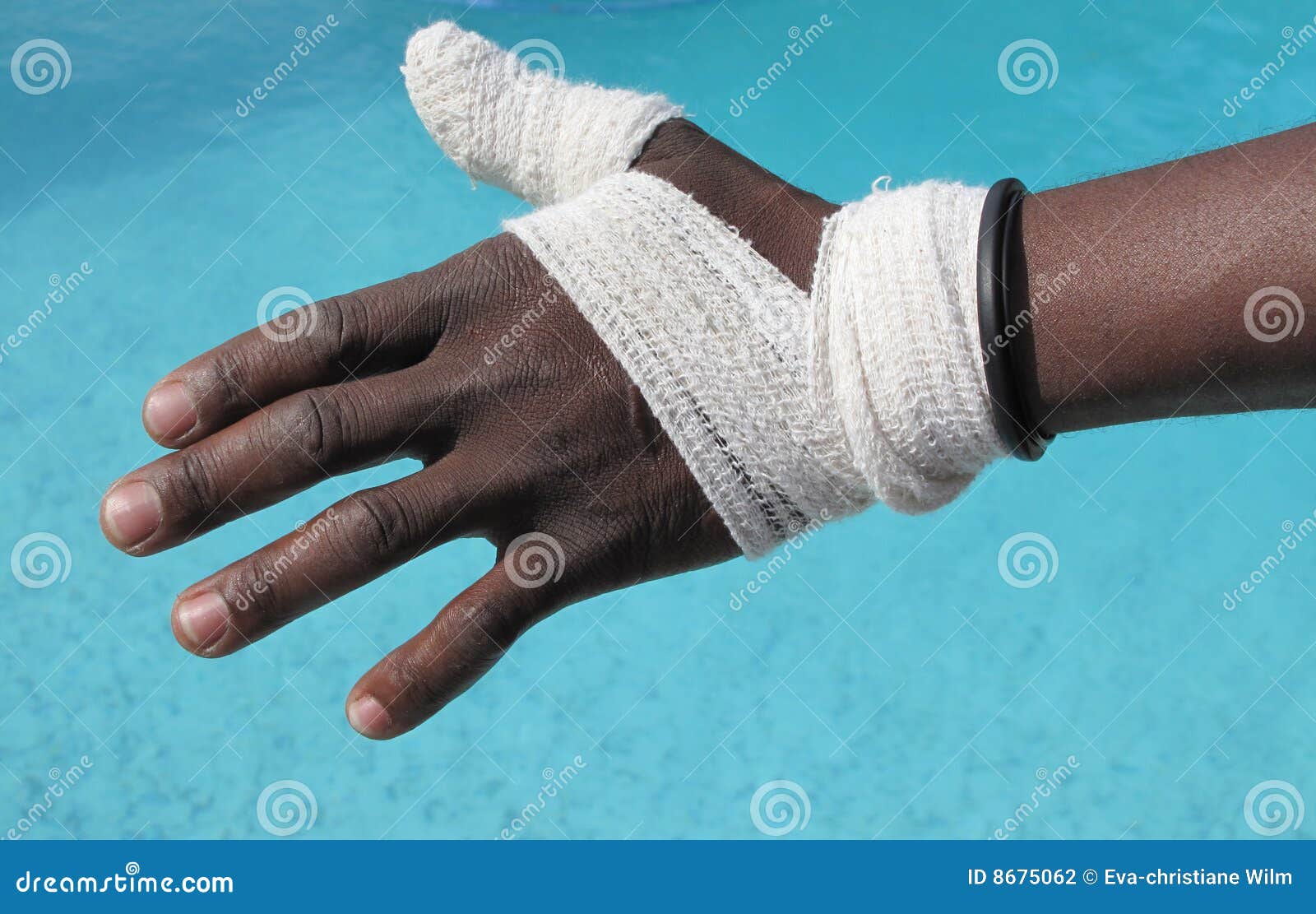 First Aid For Hurting Woman With Hand Wound Stock Photo | CartoonDealer ...