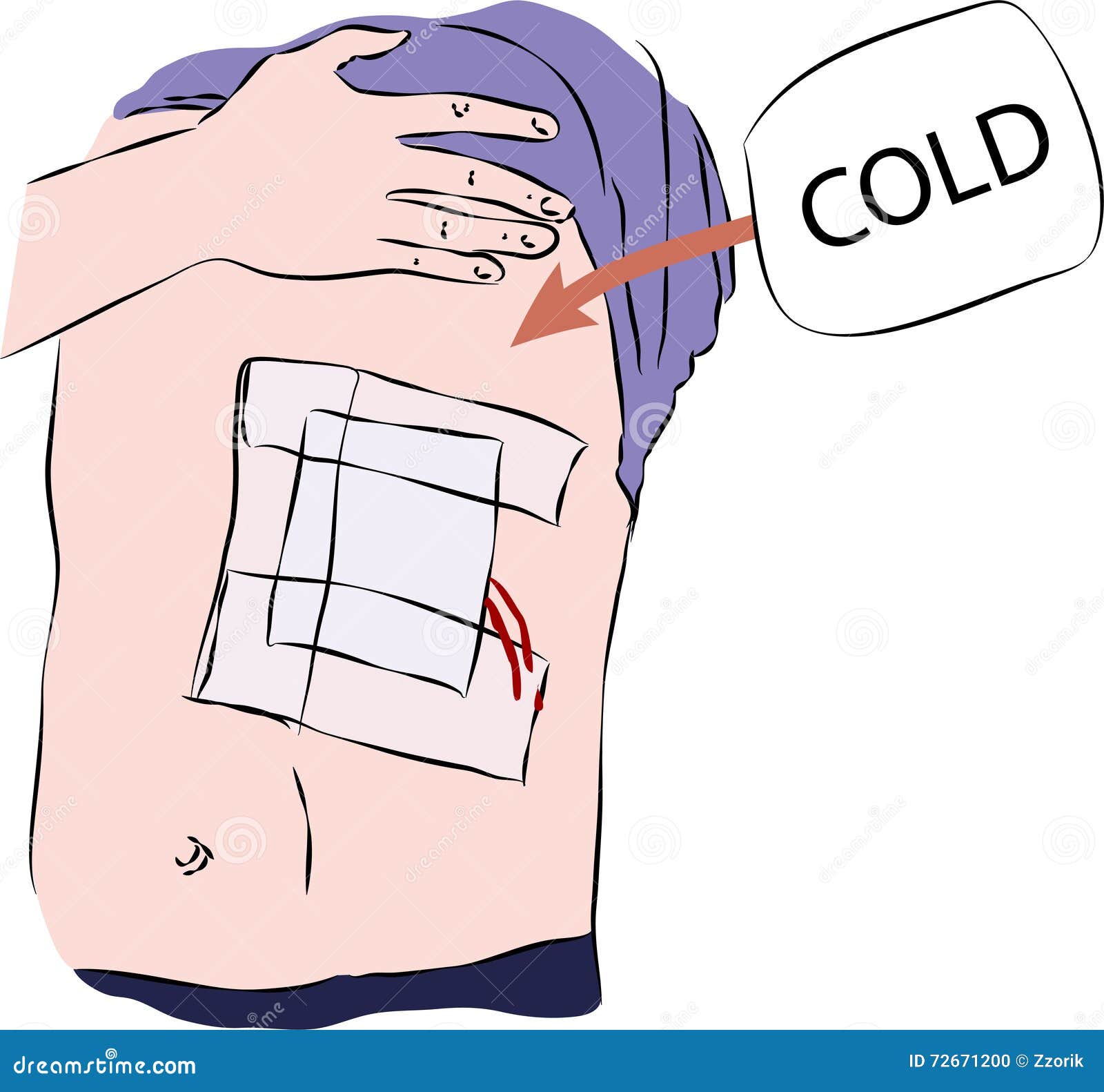 First Aid - Bandage on Body with Cold Stock Vector - Illustration of ...