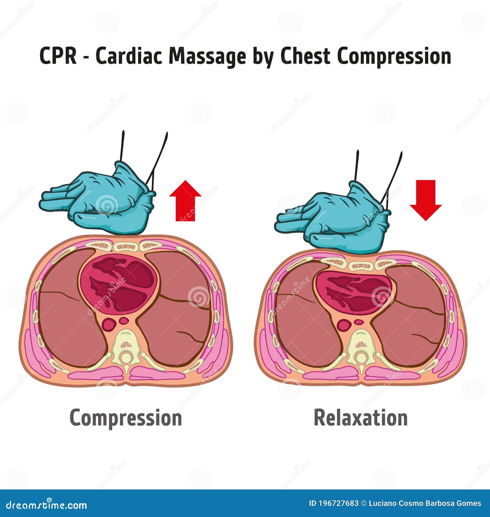 First Aid Resuscitation CPR, Chest Compression Chest Massage for ...