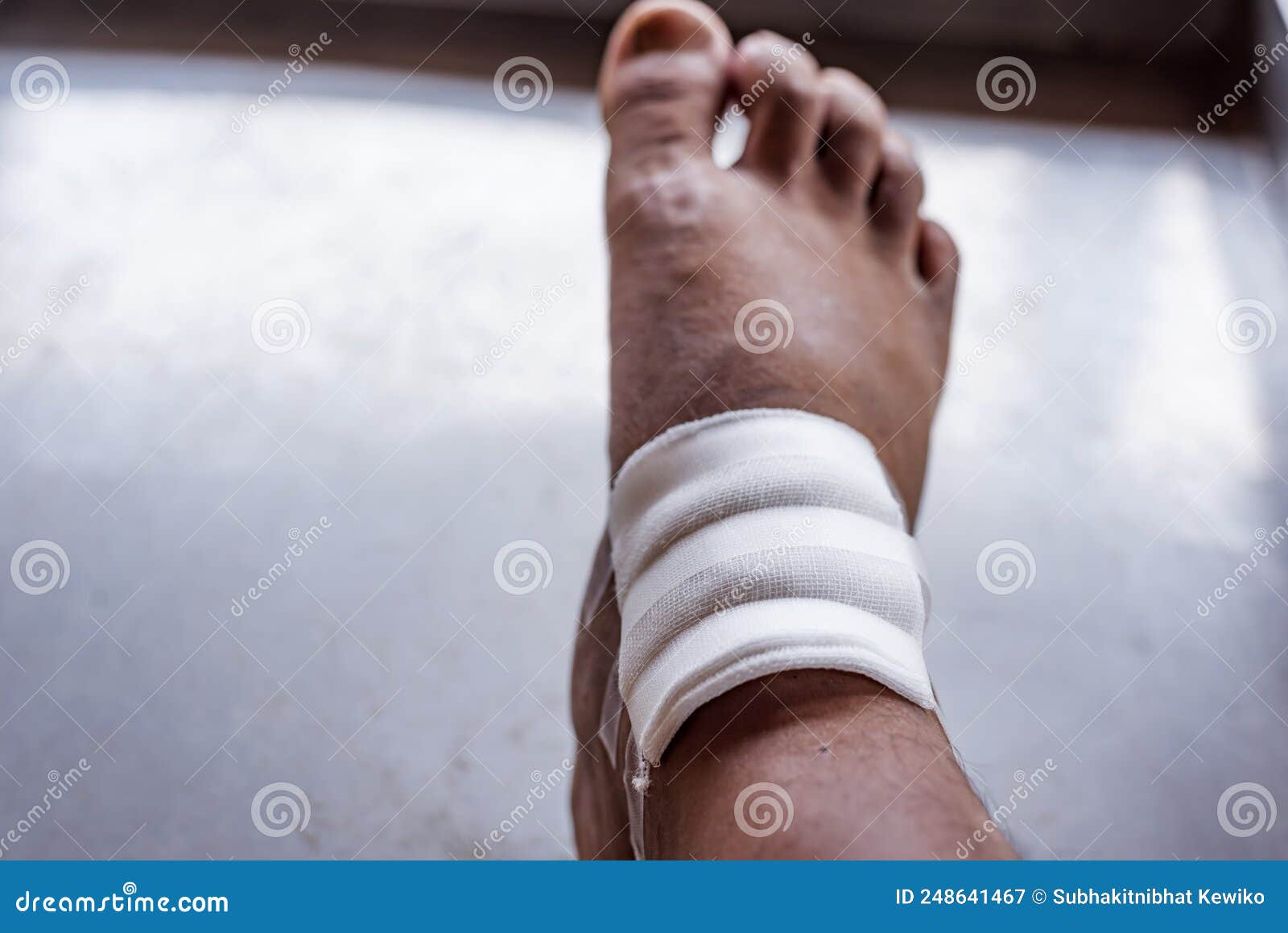 Leg injury stock image. Image of ankle, care, medicine - 248641467