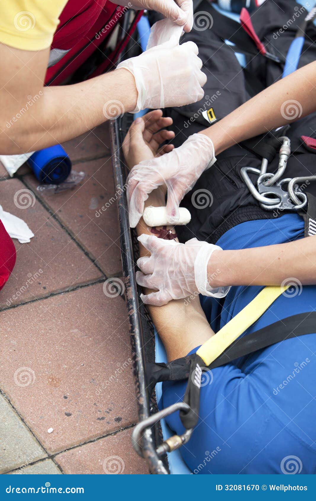 Immobilization Of Human Motor Organs Using Plaster Cast, Giving A ...