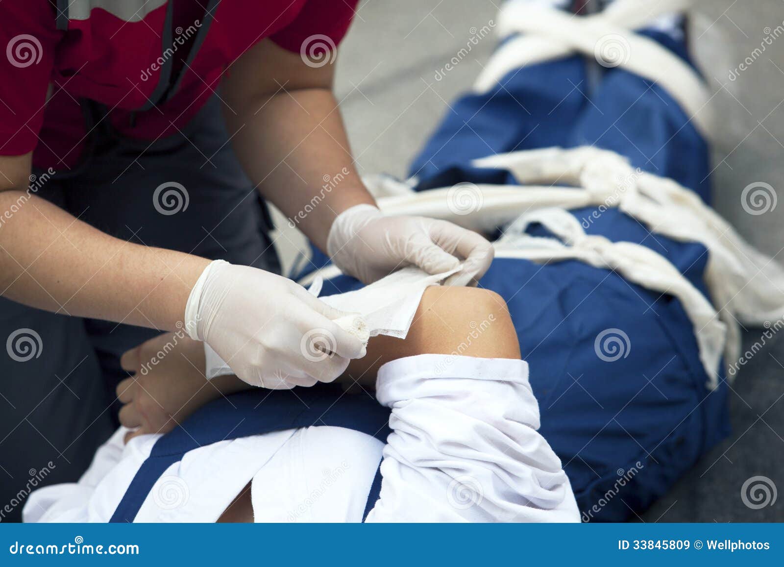 Immobilization Of Human Motor Organs Using Plaster Cast, Giving A ...