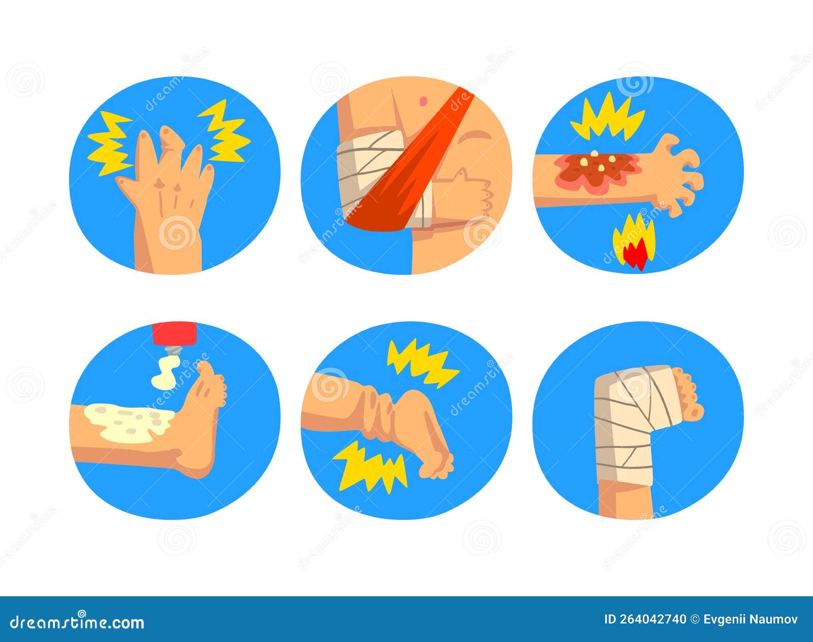 First Aid for Wounded Arm and Leg in Blue Circle Vector Set Stock ...