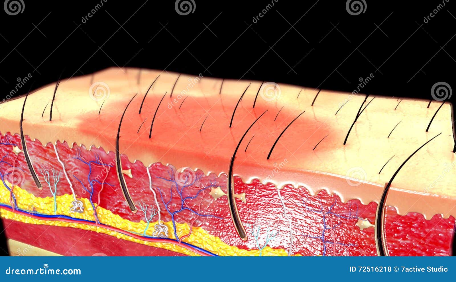 First Degree Burns Stock Video Footage by Megapixl