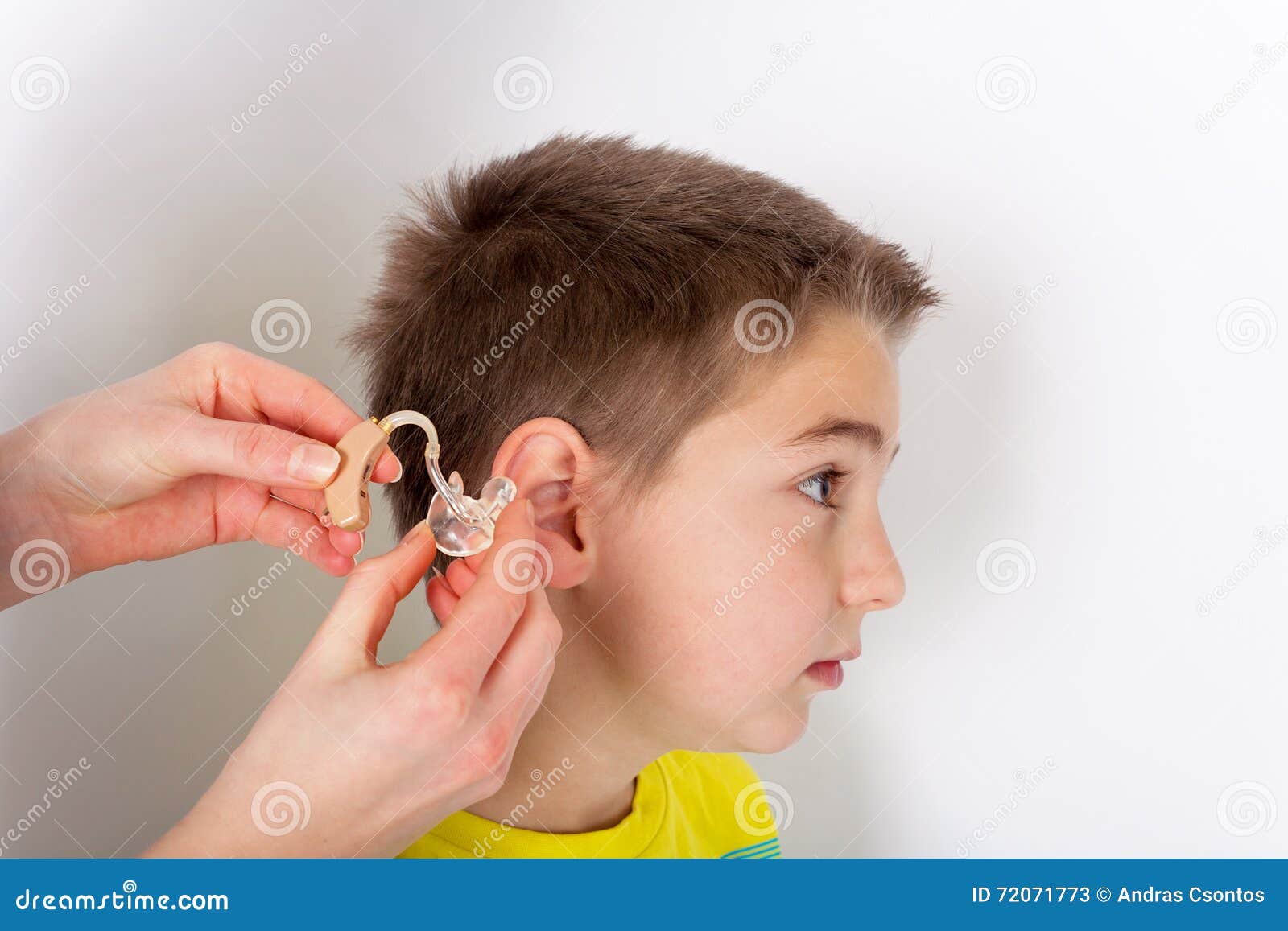 The first hearing aid stock image. Image of person, wear - 72071773