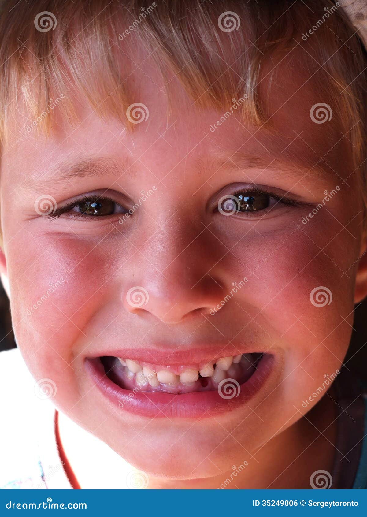 First tooth lost stock photo. Image of grimace, human - 35249006