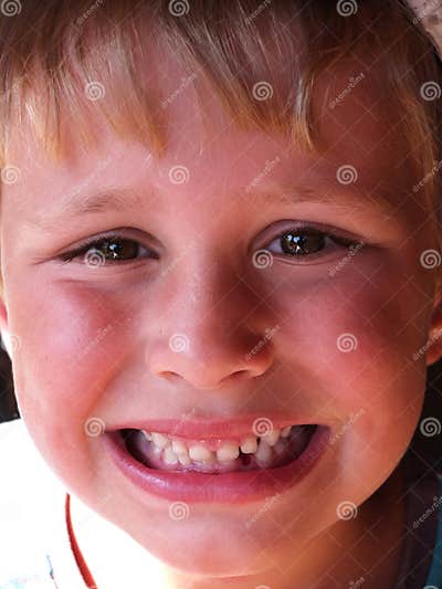 First tooth lost stock photo. Image of grimace, human - 35249006
