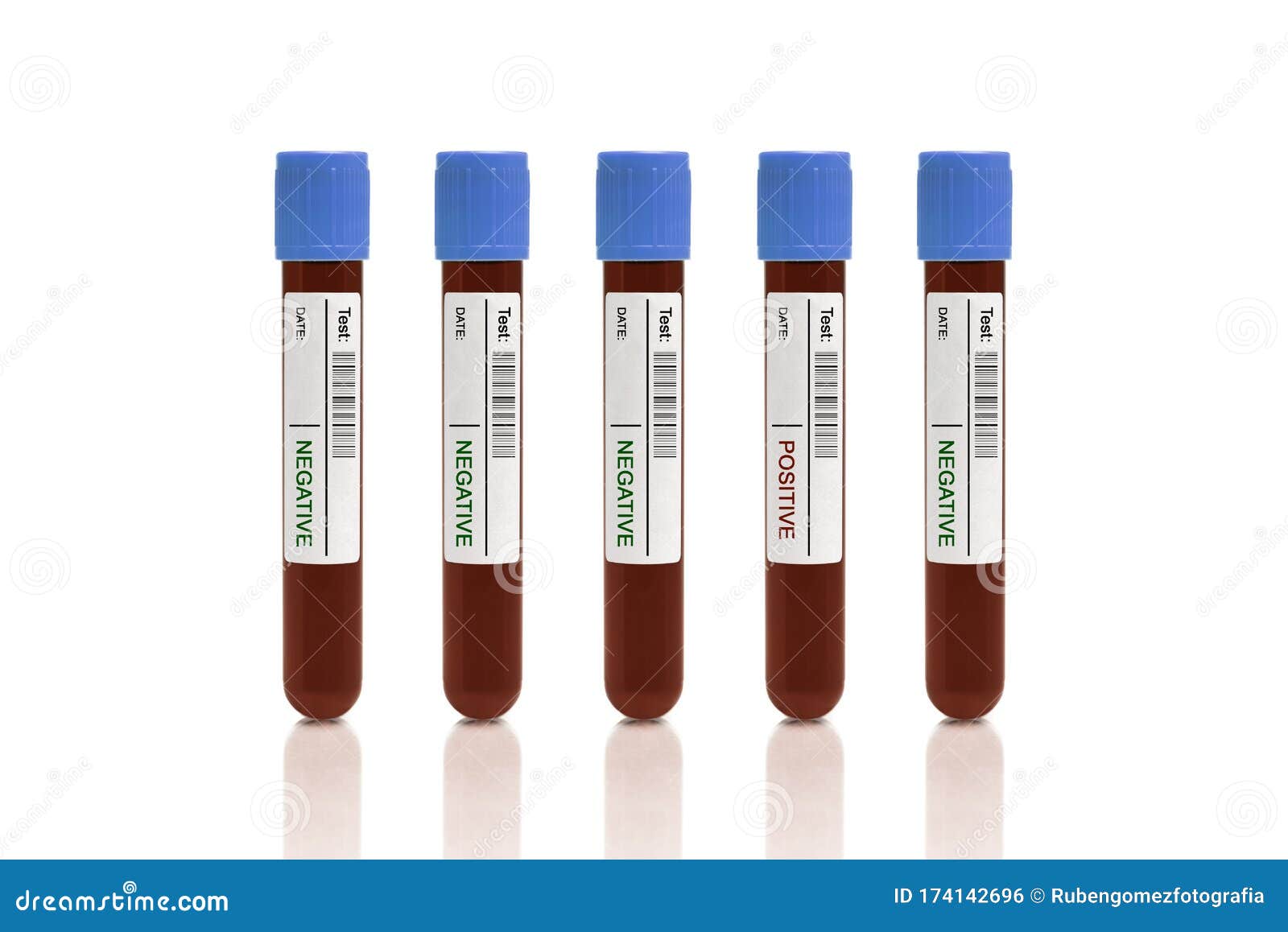 Vials Of Blood In A Centrifuge. Negative COVID-19 Test And Laboratory ...