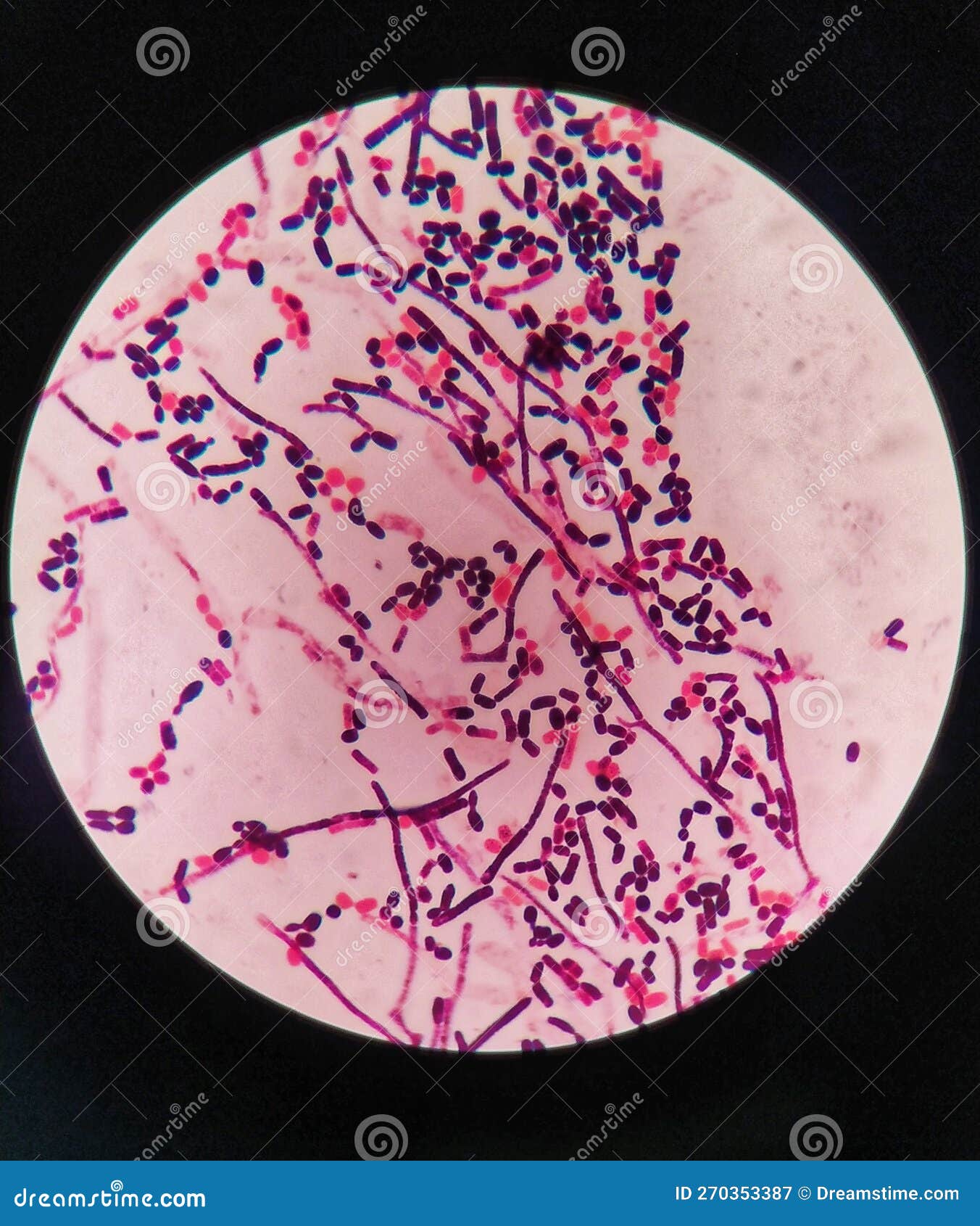 Yeast Cells and Hyphae in Gram Stain Fine with Microscope. Stock Image ...