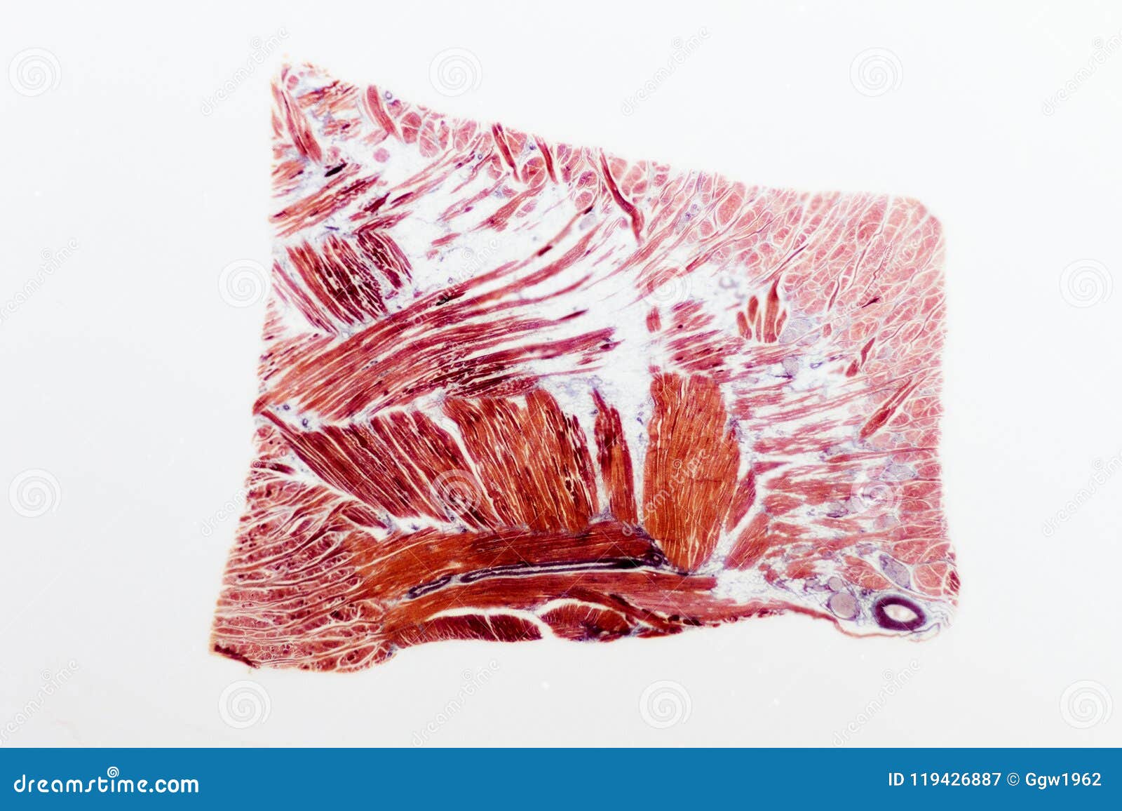 Skeletal Muscle Fixed Slide Stock Image - Image of histology, animal ...