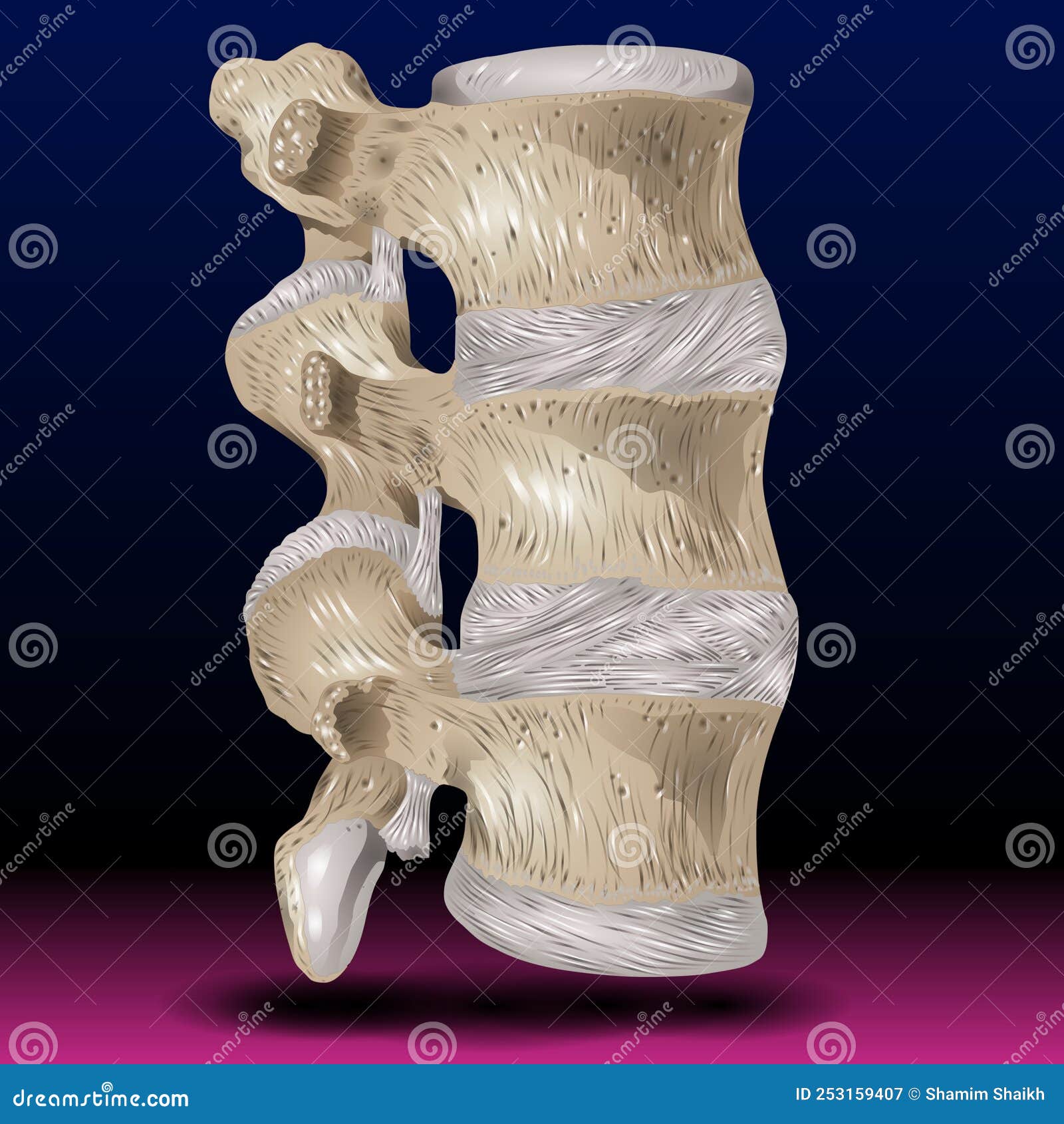 Spondylitis - Human Anatomy - Healthcare - Science Stock Illustration ...