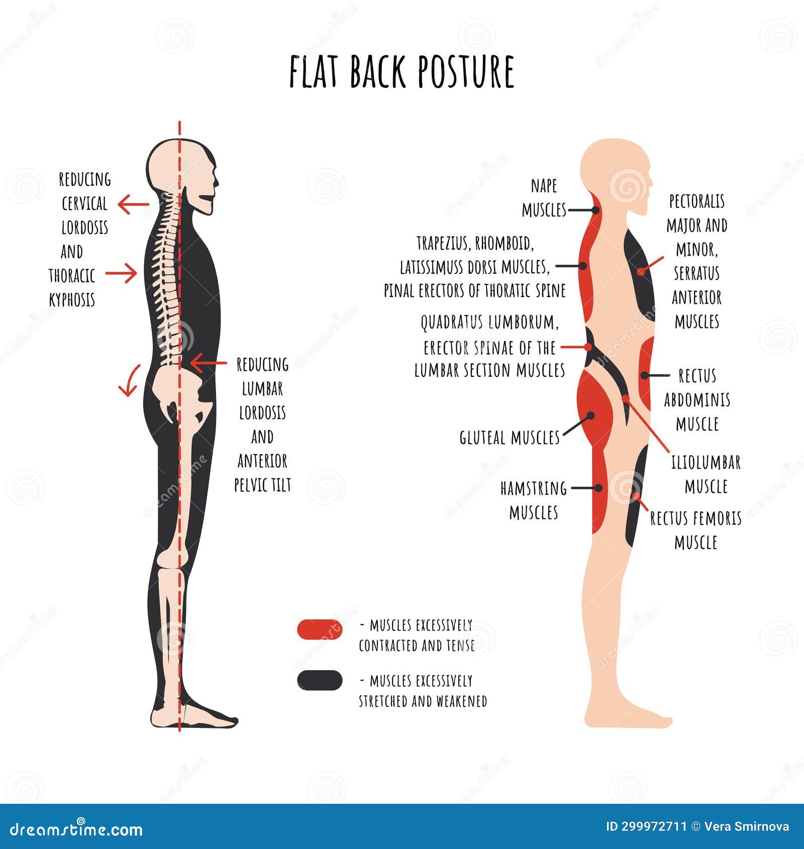 Spine Curves Spinal Deformity Symbol Of Spine Curvatures Or Unhealthy Backbones Human Spine