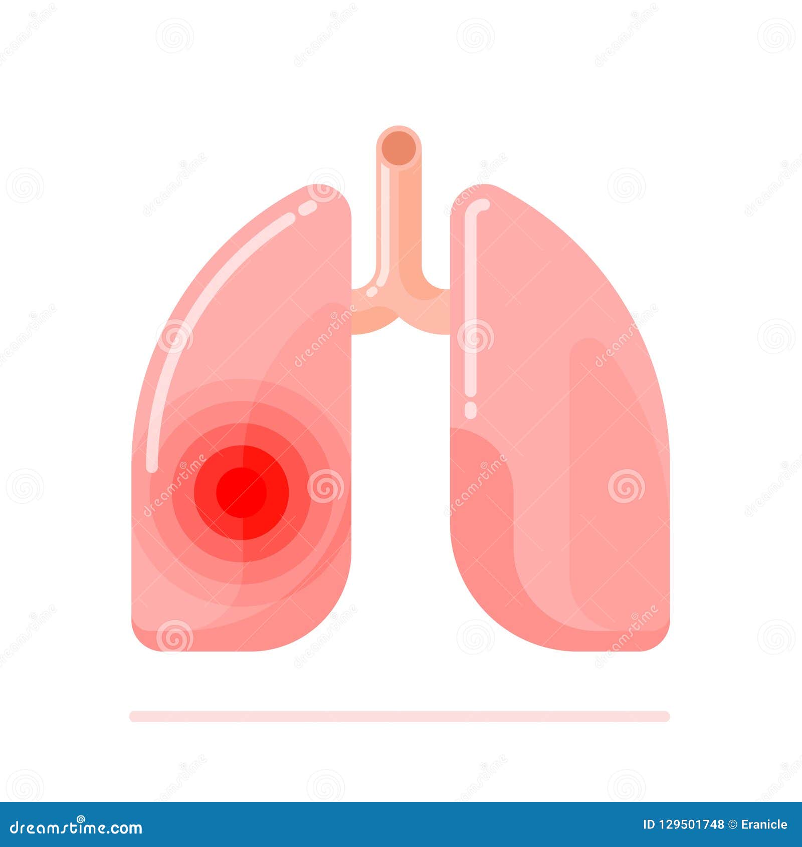 Flat Design Illustration of Human Lungs Disease Stock Vector ...