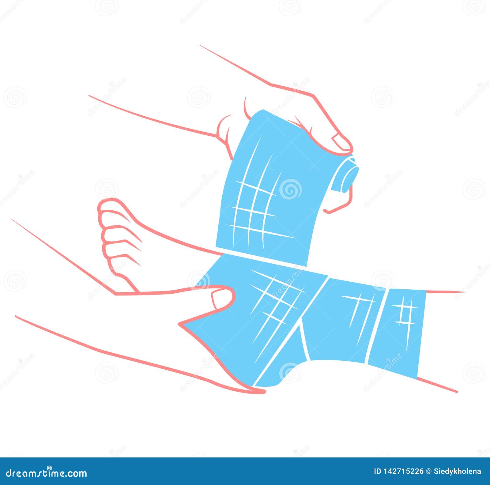 Dislocation Of The Foot Back, Vintage Engraving Cartoon Vector ...