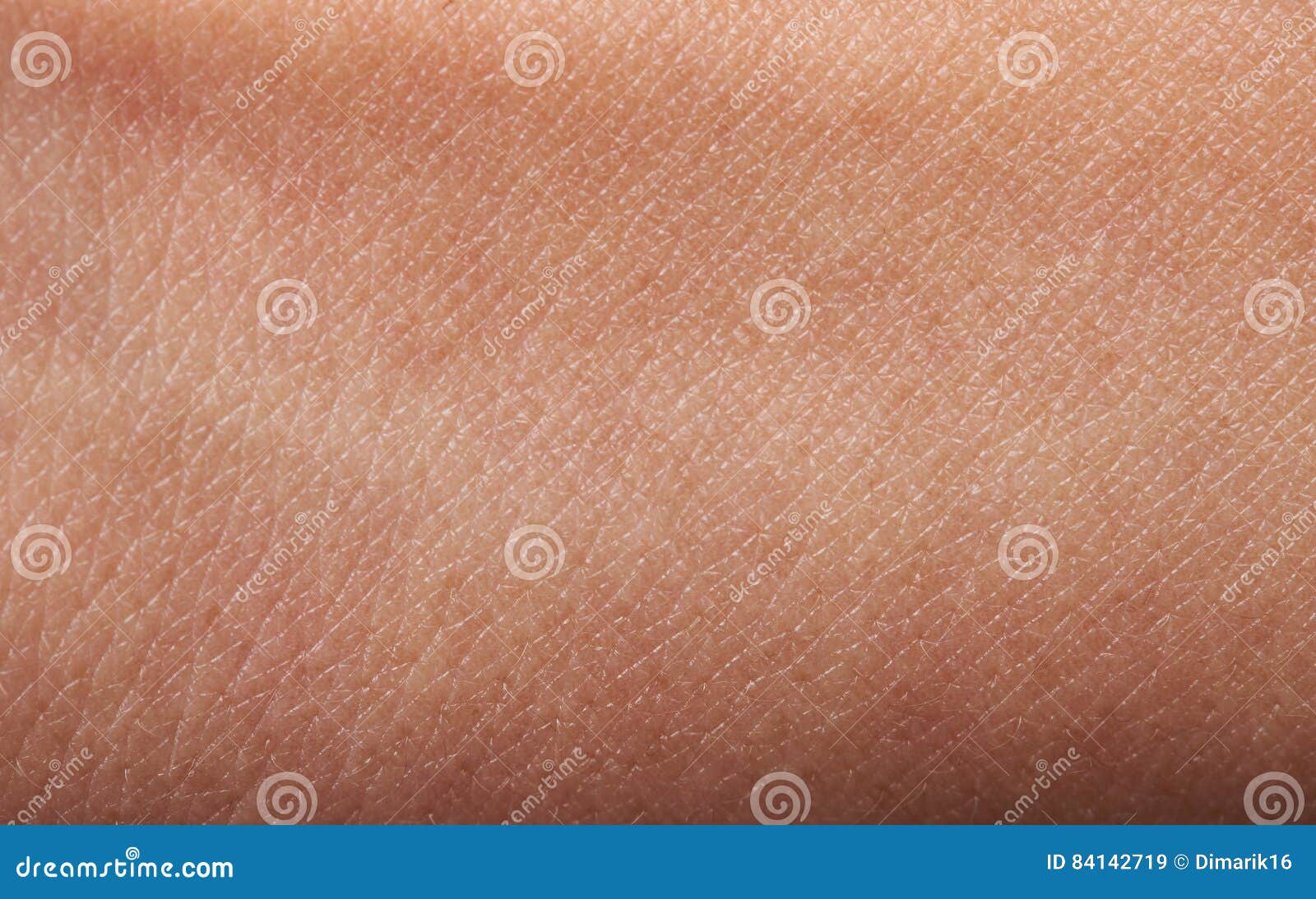 Flat Human Skin Stock Image Image Of Asian Cancer Hairs 84142719