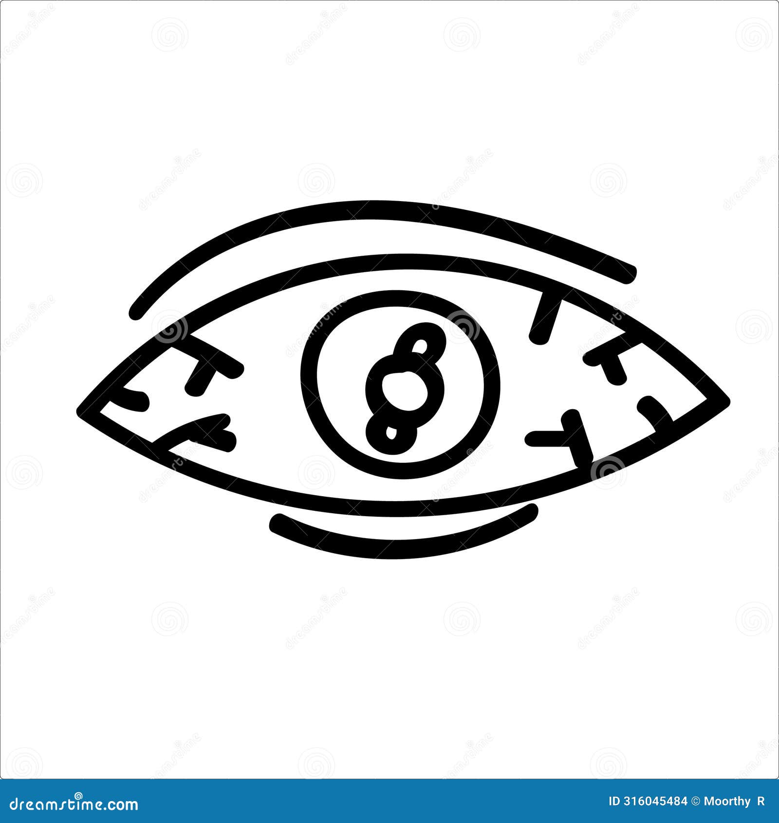 Open-angle Glaucoma. A Common Type Of Glaucoma. The Anatomical ...