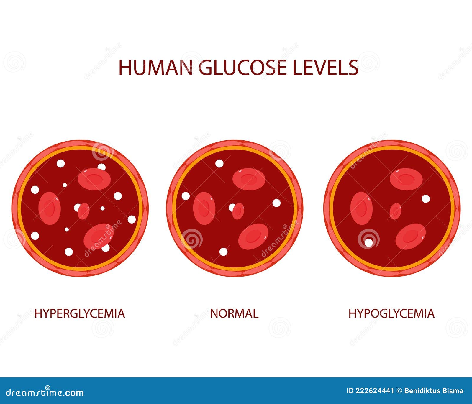 Flat Illustrations of Human Glucose Levels Stock Vector - Illustration ...