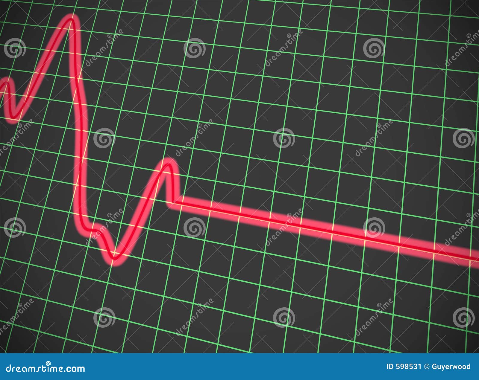 Flat Lining Stock Illustrations – 566 Flat Lining Stock Illustrations ...