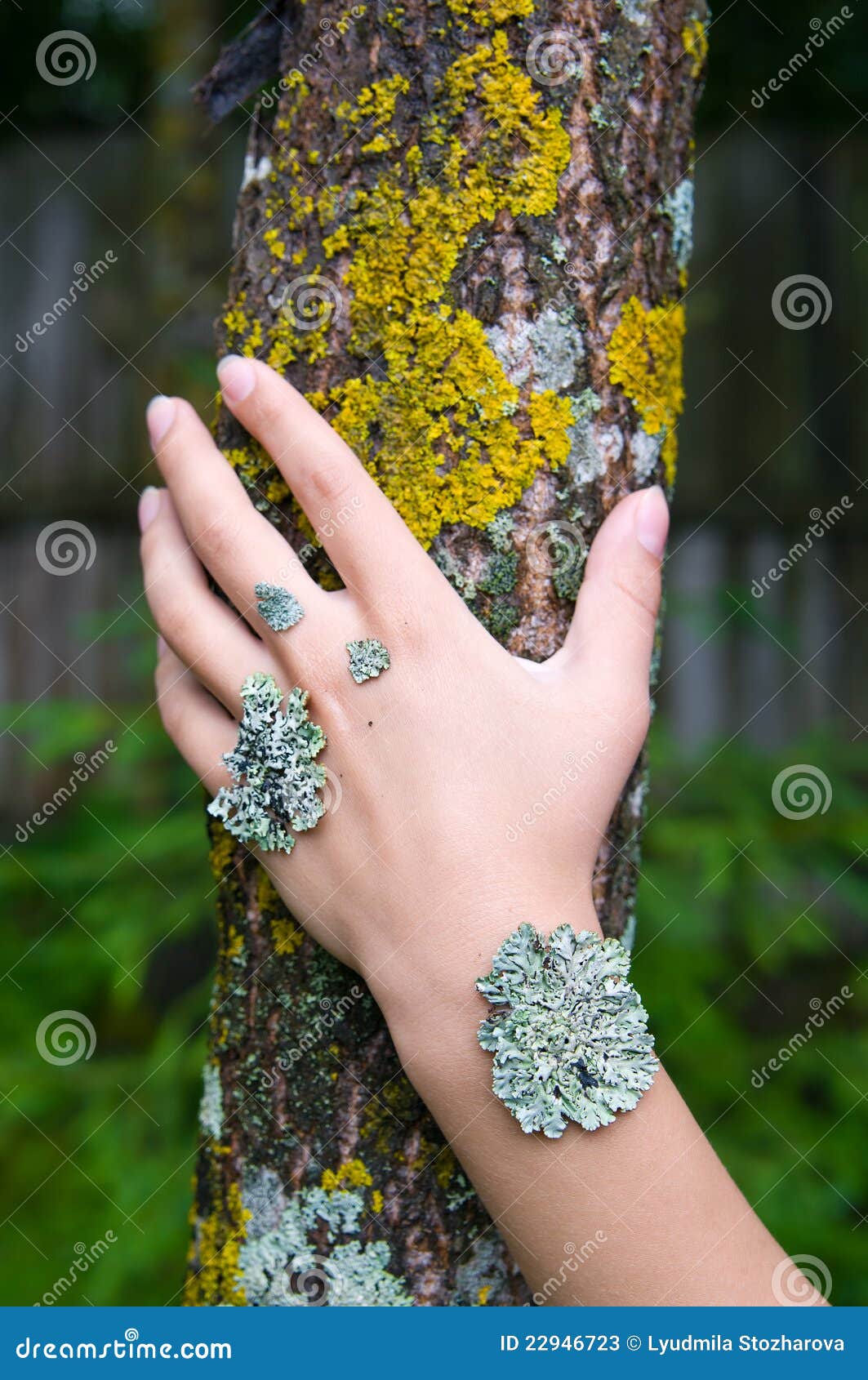 Flechte auf der Hand stockbild. Bild von medizinisch - 22946723