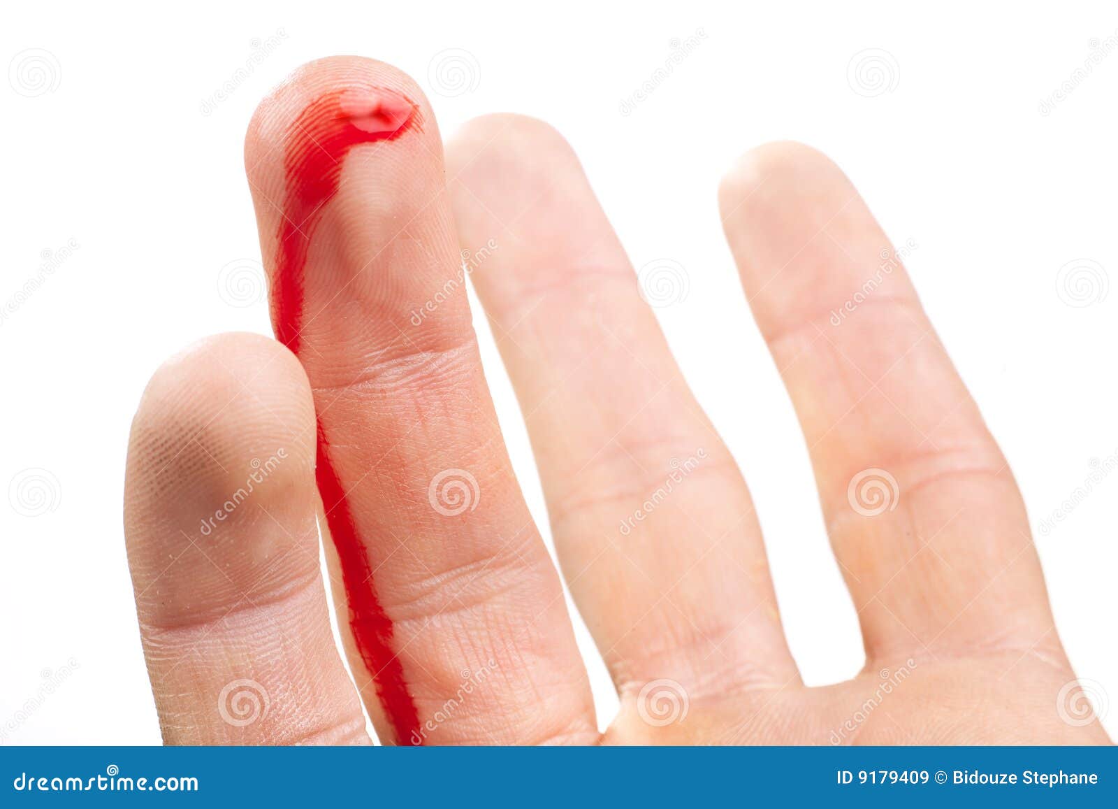 Fleischwunde stockbild. Bild von schmerzlich, stelle, hand - 9179409