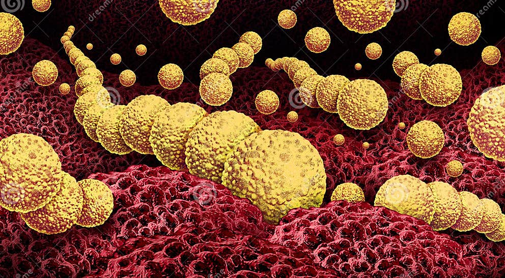 Flesh Eating Bacteria Stock Illustration Illustration Of Bacterial