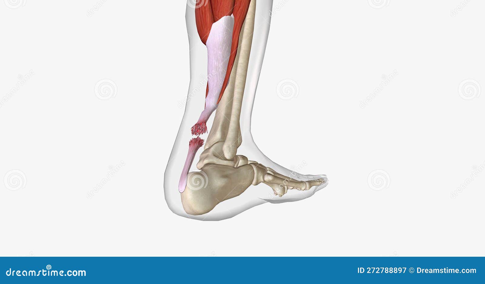 Flexion And Extension With Torn Achilles Tendon Stock Image ...