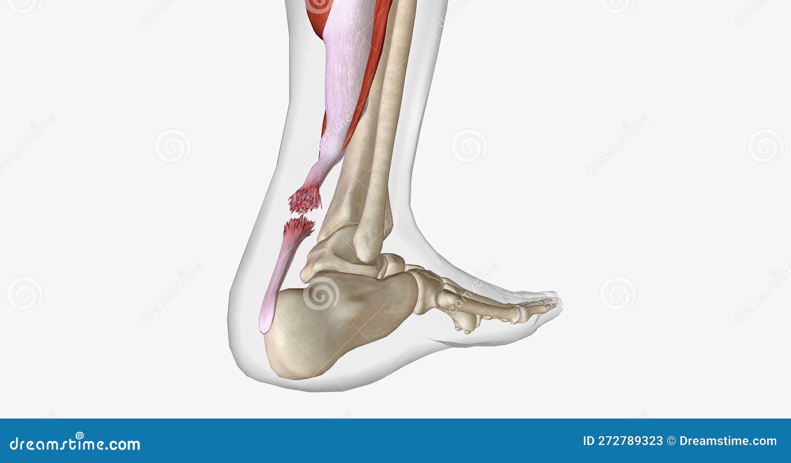 Flexion and Extension with Torn Achilles Tendon Stock Illustration ...