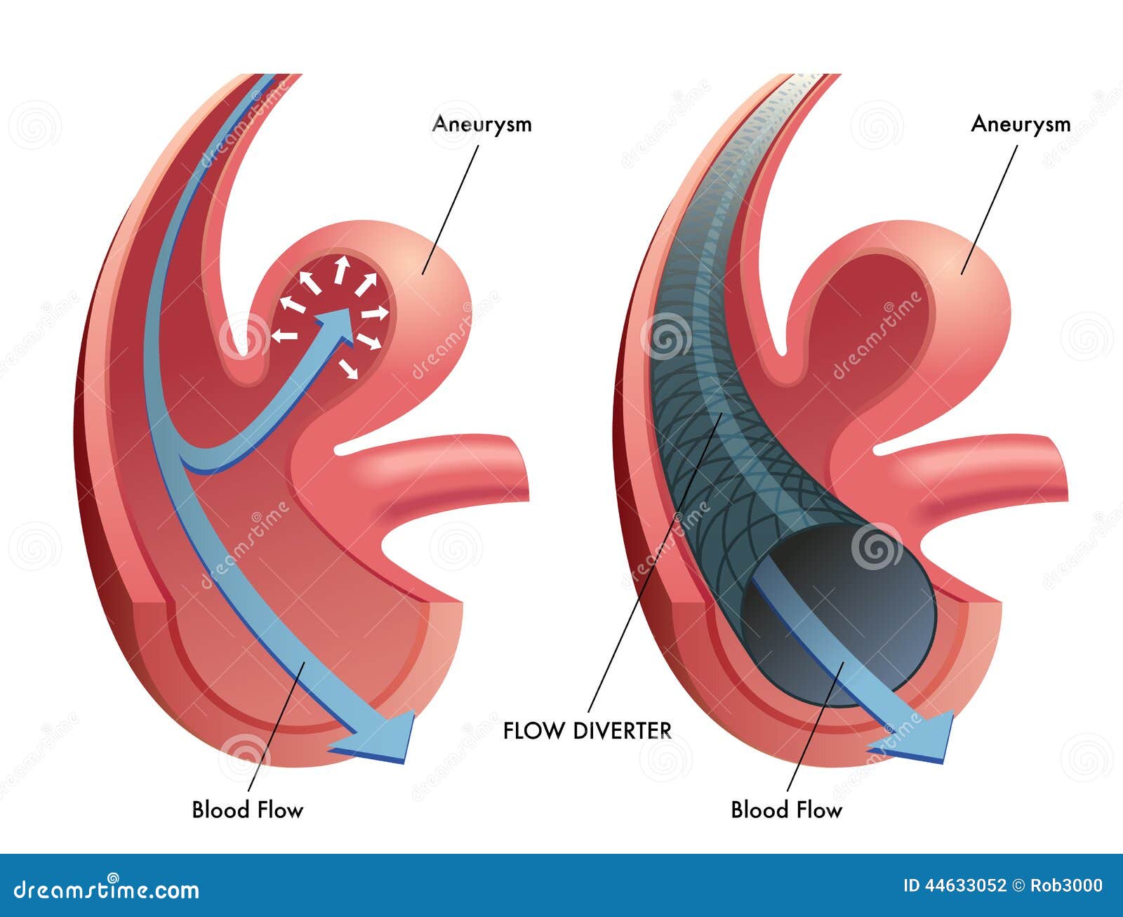 Diverter Cartoons, Illustrations & Vector Stock Images - 33 Pictures to ...