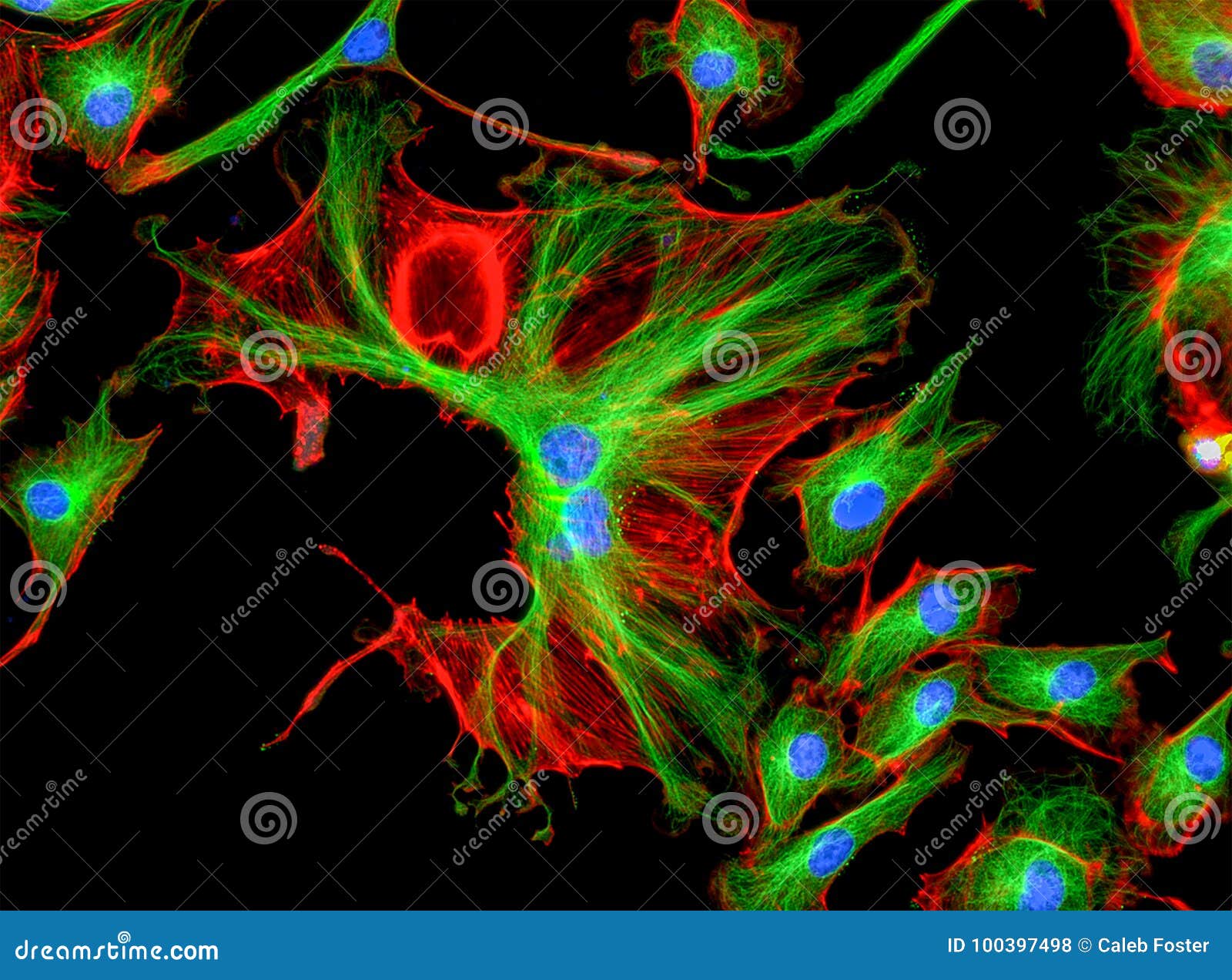 Fluorescence Microscope Image of Human Cells Undergoing Mitosis Stock ...