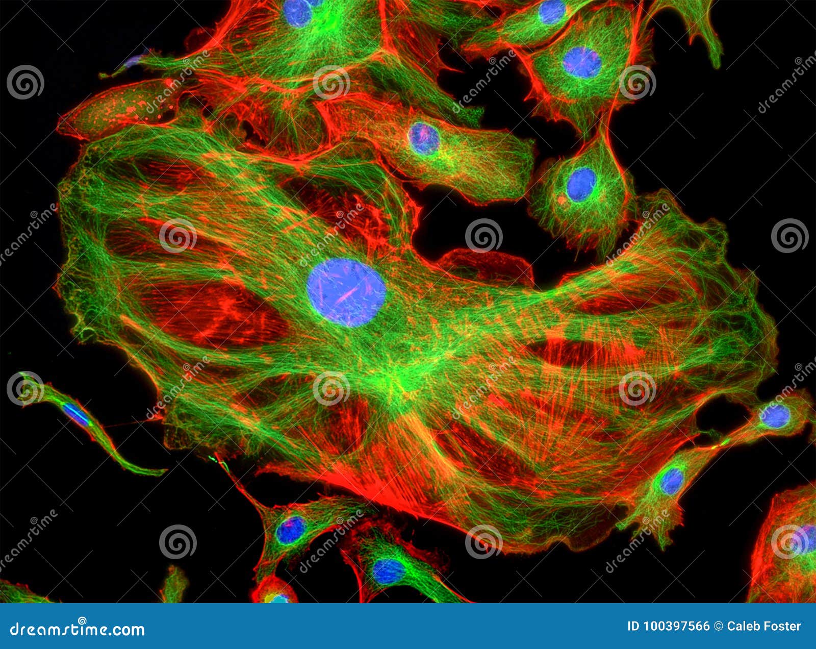 Fluorescence Microscopy Instrument Principle And Structure Outline ...