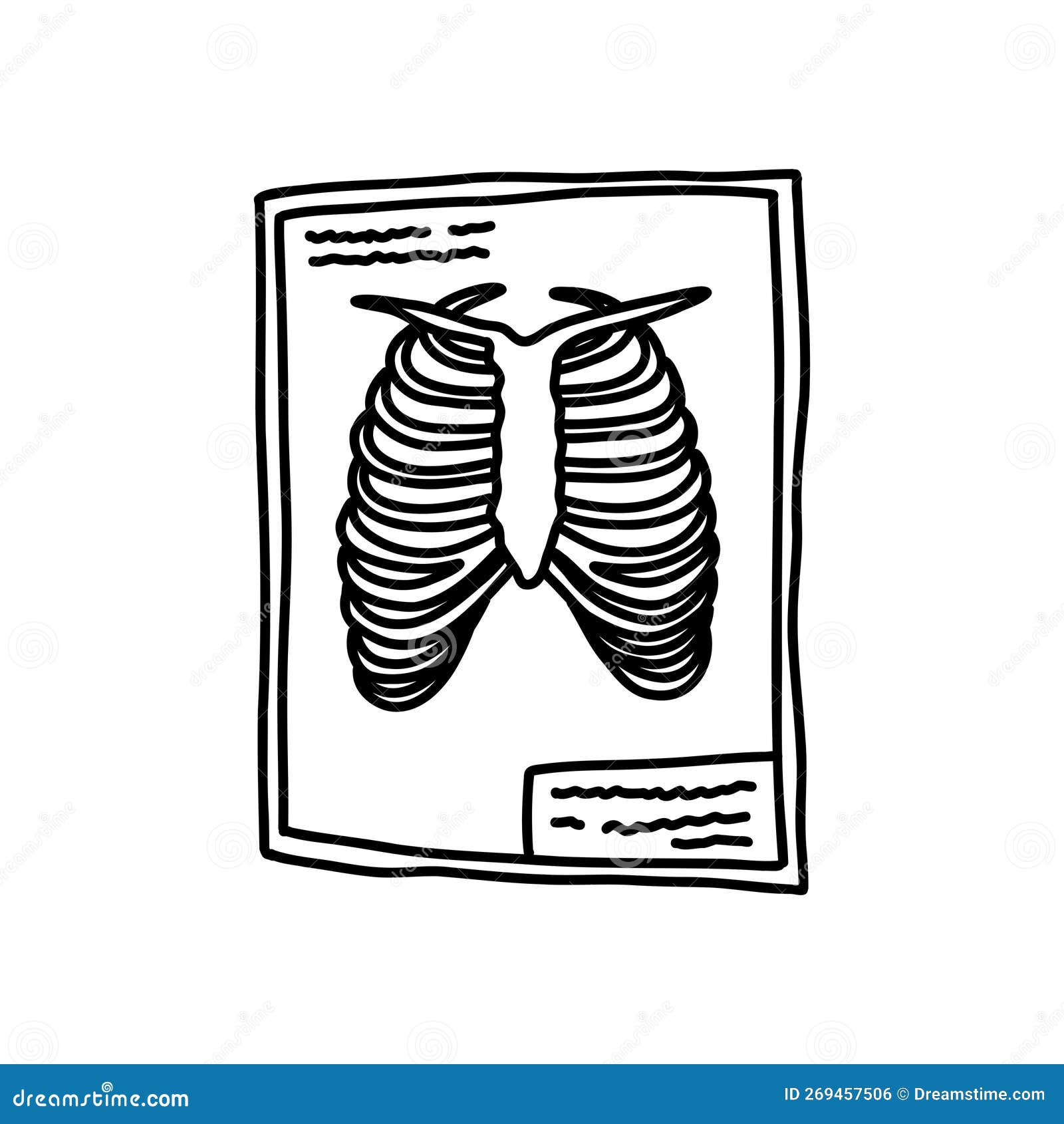 Fluorography Exam Of Patient Female. Chest Xray Scan, Roentgen, Chest ...