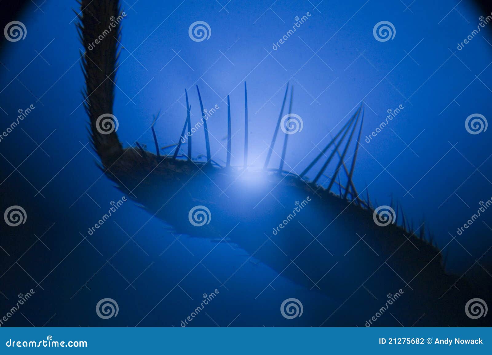 Fly Leg Under the Microscope Stock Photo - Image of examination, thumb ...