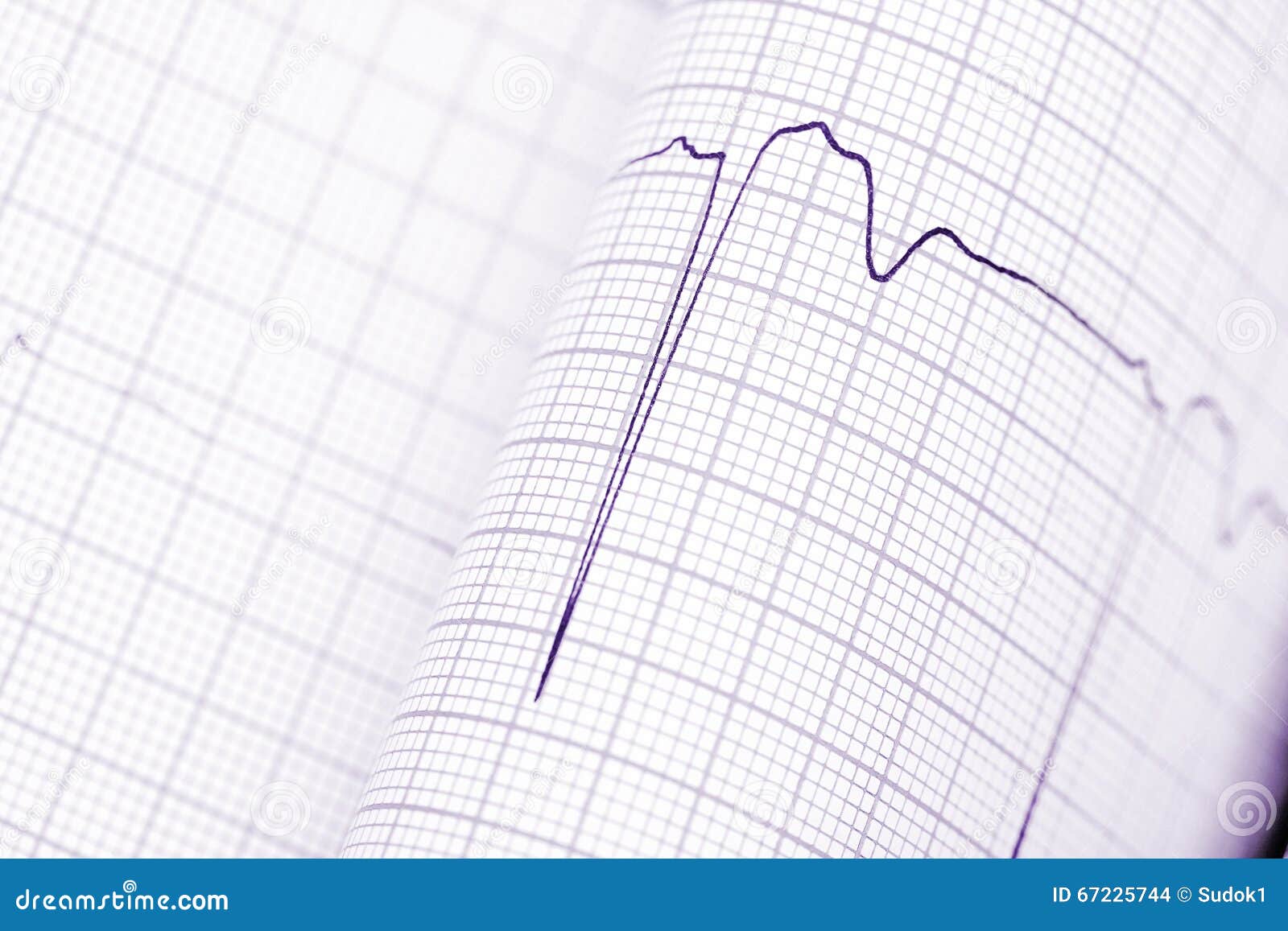 Folded Graph Paper With ECG Royalty-Free Stock Image | CartoonDealer ...