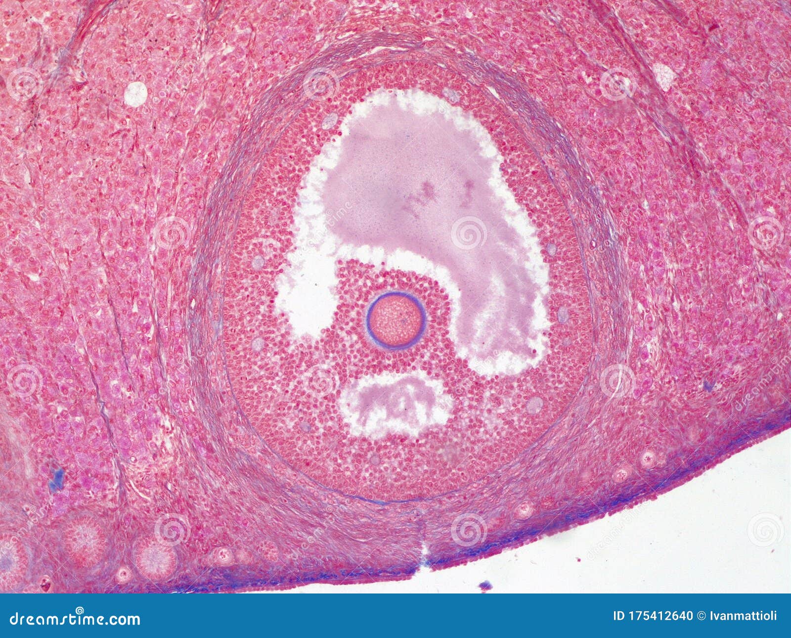 Ovary Slide Labeled Ovum