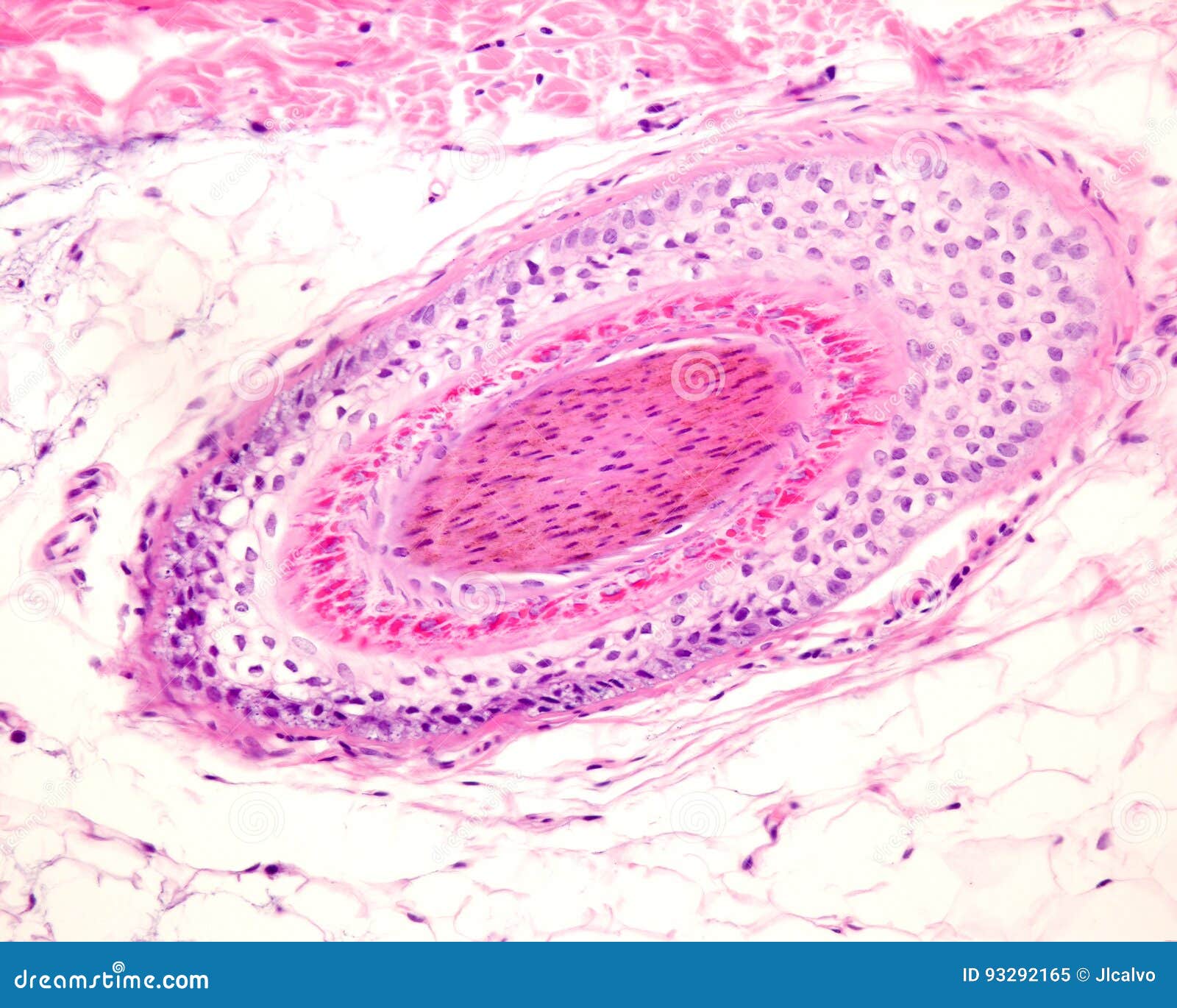 Follicolo Stock Photos - Royalty Free Images