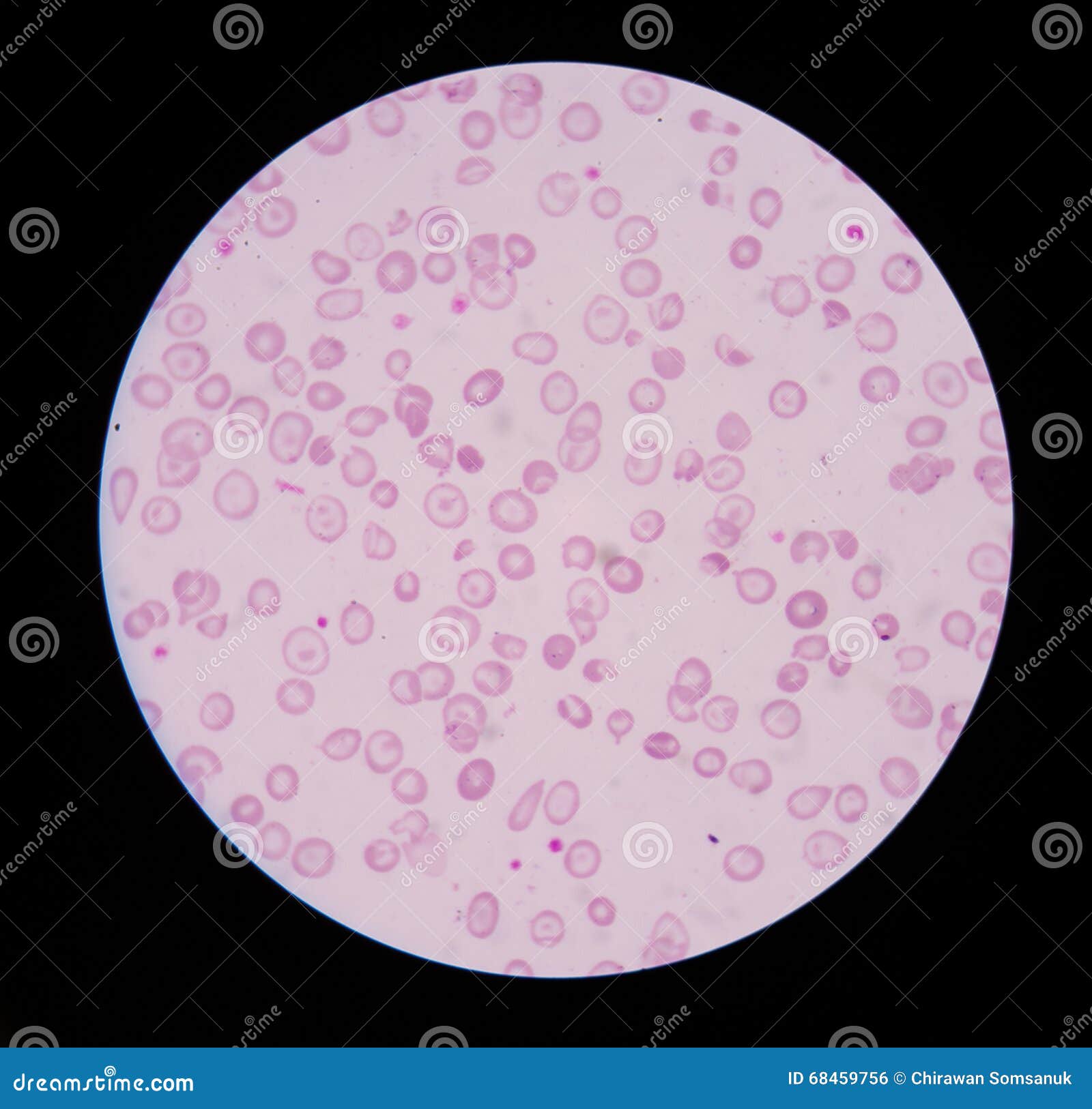 Fond Anormal De La Science De Globules Rouges Photo stock - Image of ...