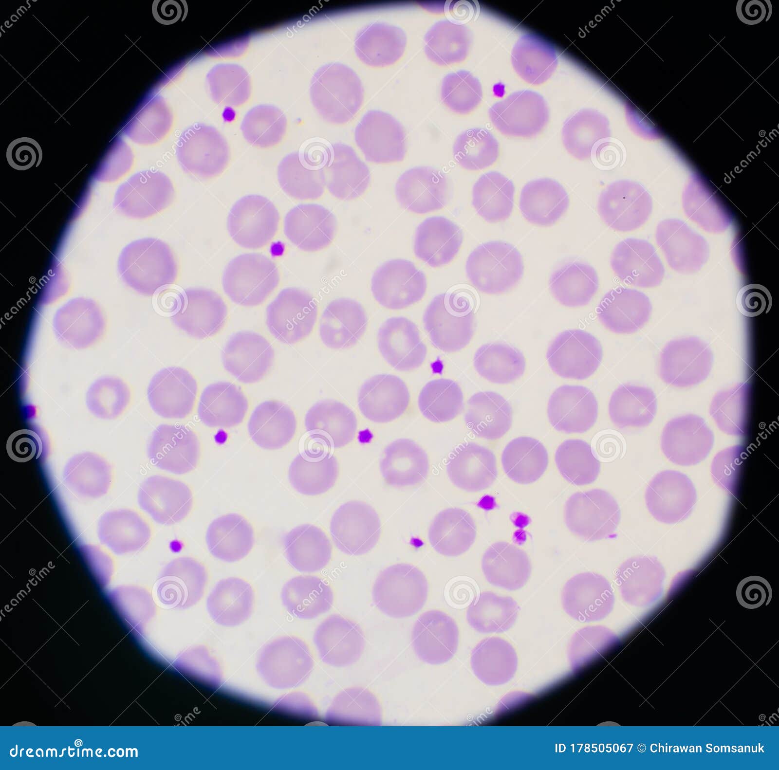 Fond Normal De Globules Rouges Image stock - Image du cellule ...