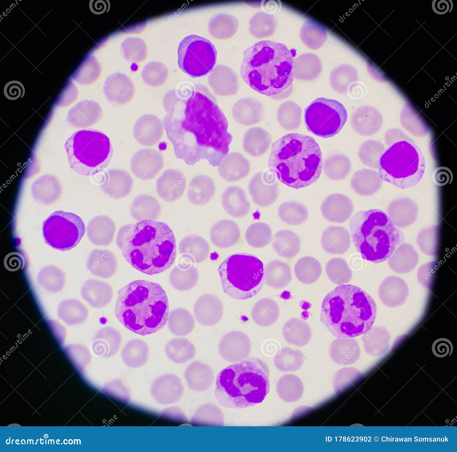 Fond Normal De Globules Rouges Photo stock - Image du lymphocytes ...