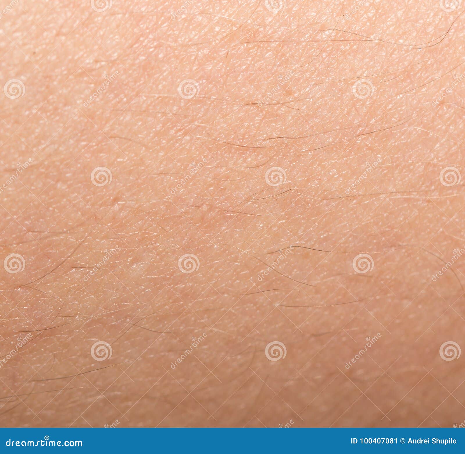 Fondo de la piel humana imagen de archivo. Imagen de salud - 100407081
