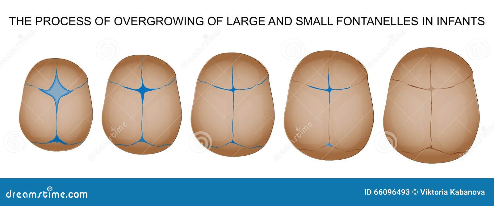 Fontanelle in pasgeborenen vector illustratie. Illustration of frontaal ...
