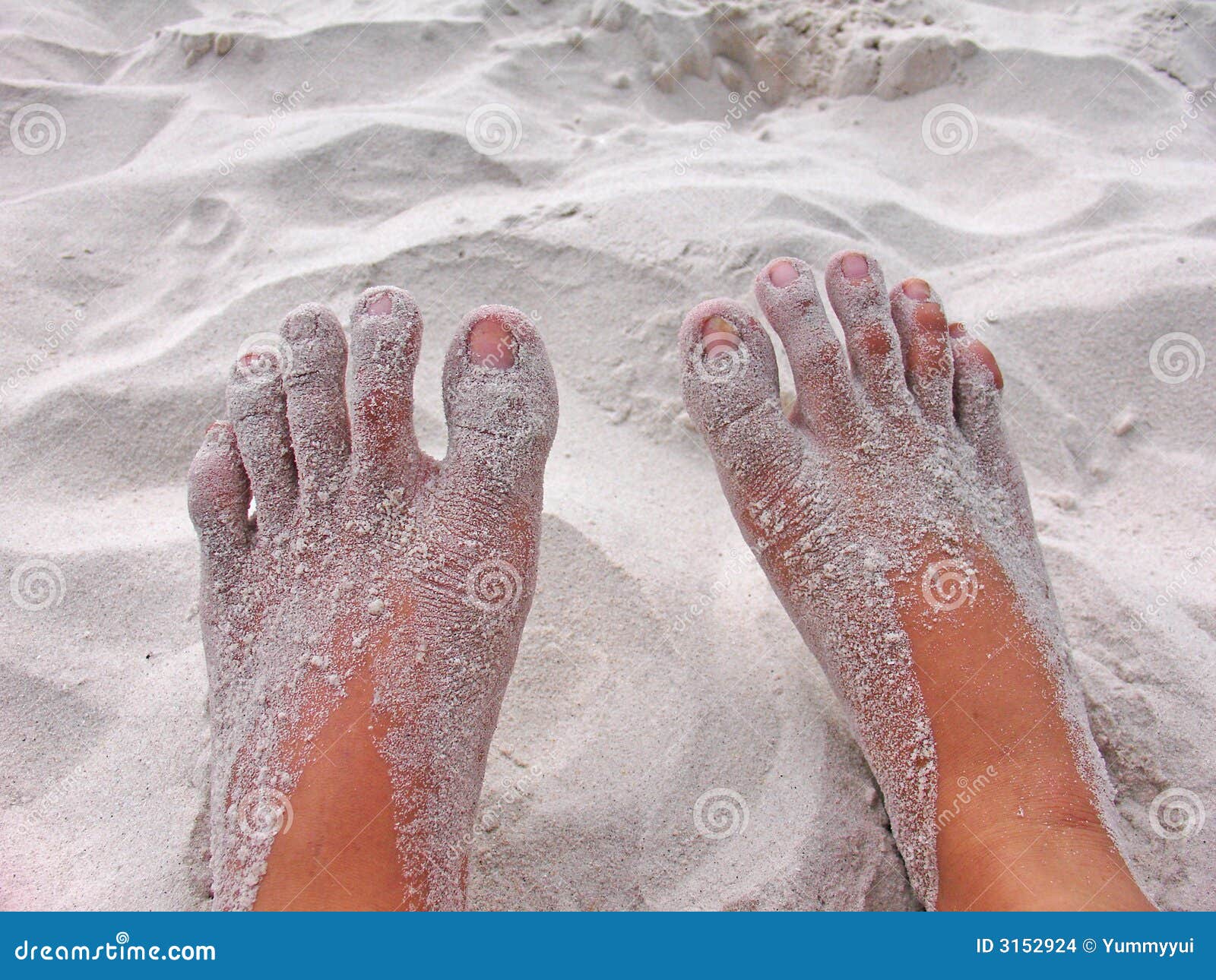 Foot stock photo. Image of feet, injury, orthopedic, healthcare - 3152924