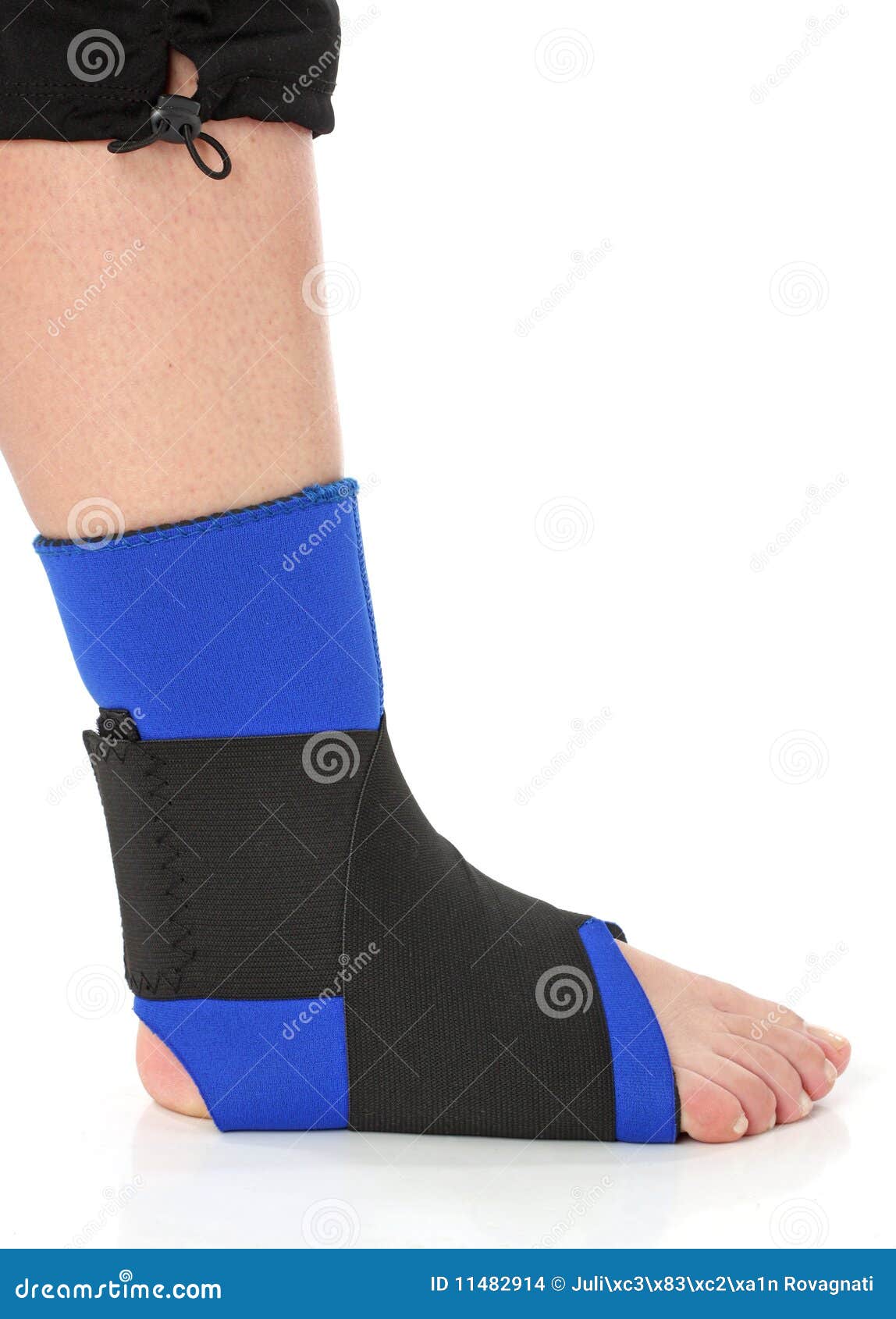 Foot with an ankle brace stock photo. Image of orthopaedic - 11482914