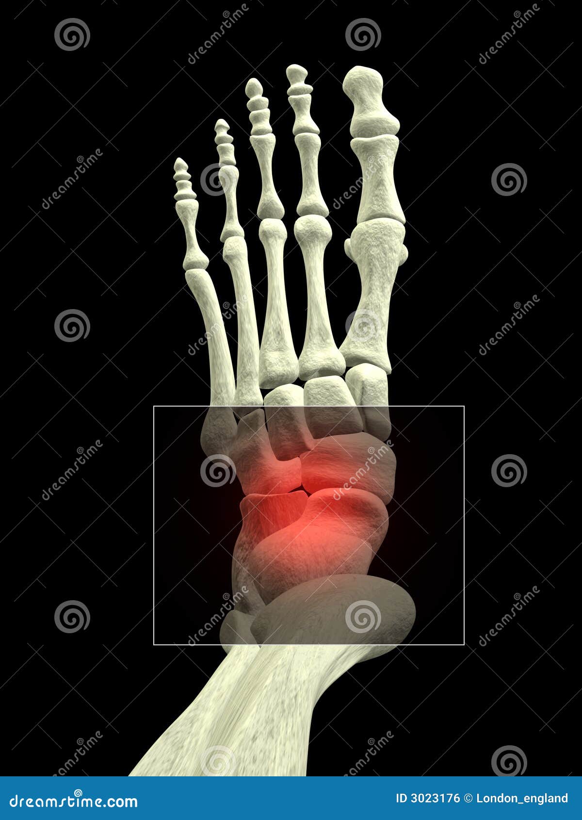 Foot And Ankle Pain, Conceptual 3D Illustration. Foot Anatomy Royalty ...