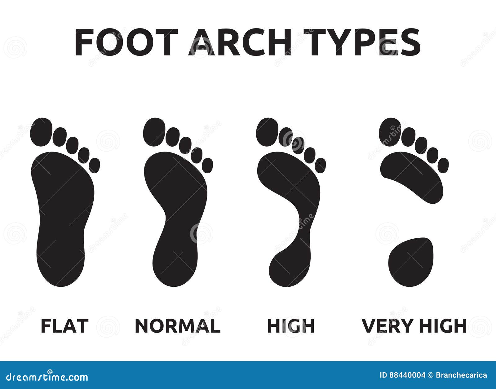 Foot arch types stock vector. Illustration of normal - 88440004 Foot arch types stock vector. Illustration of normal - 88440004